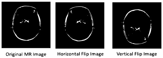 DaSAM: Disease and Spatial Attention Module-Based Explainable Model for ...
