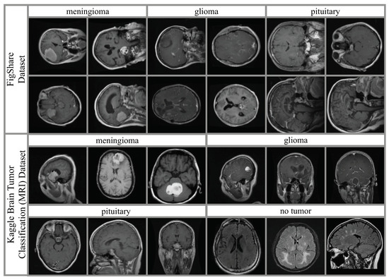 DaSAM: Disease and Spatial Attention Module-Based Explainable Model for ...