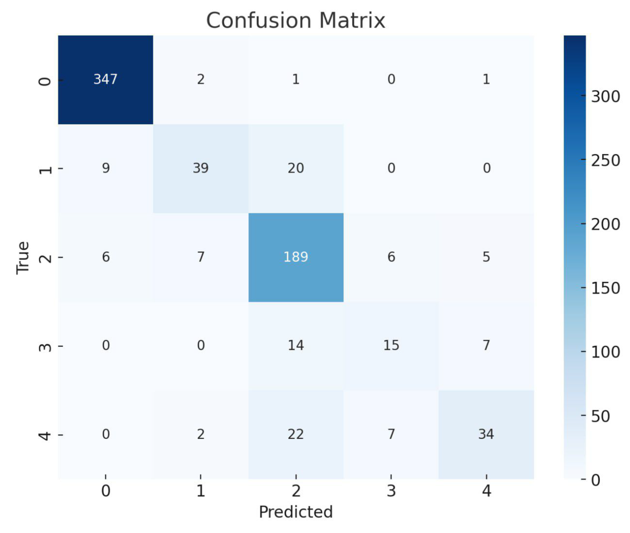 Early Detection and Classification of Diabetic Retinopathy: A Deep ...