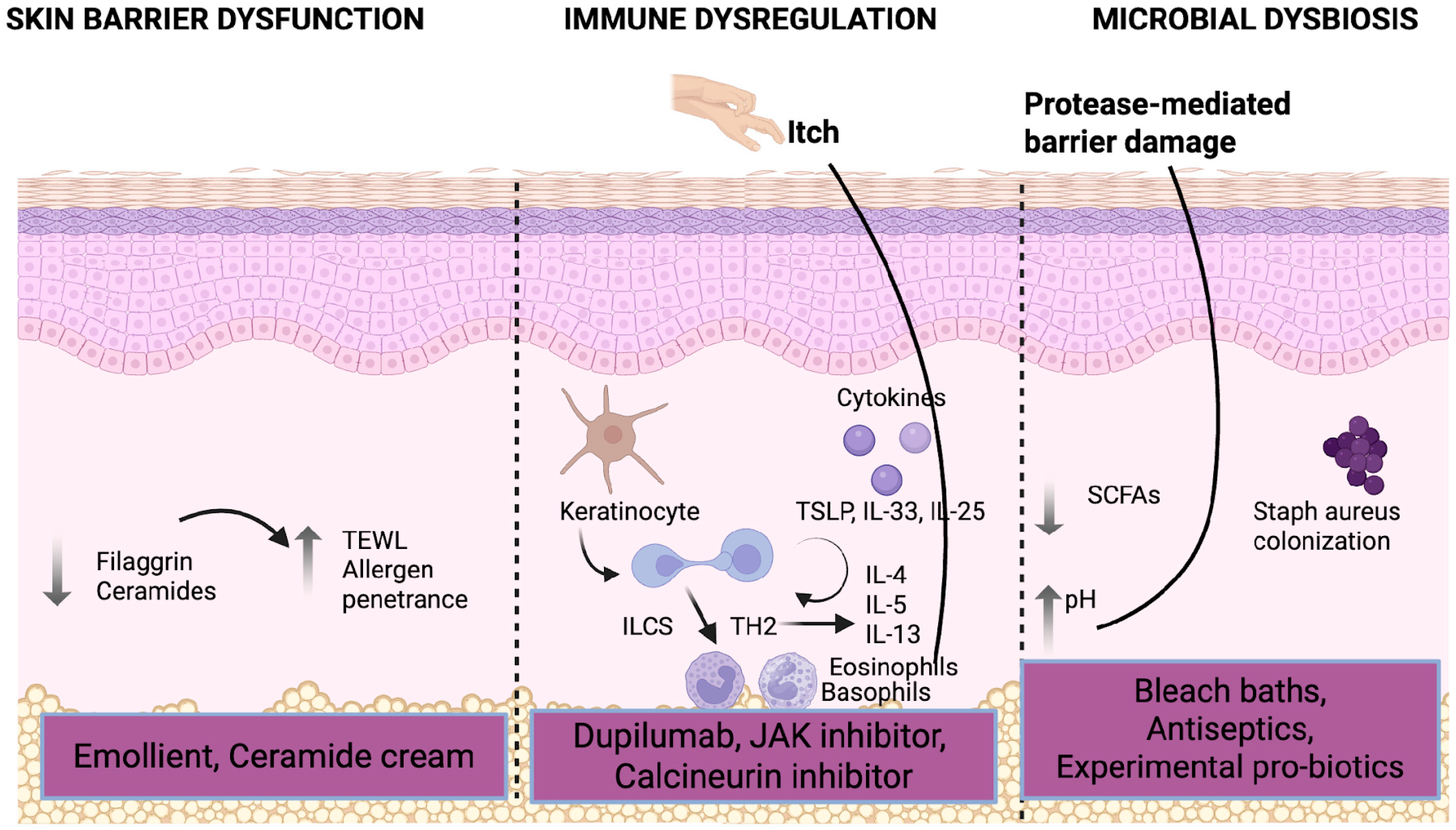 Atopic Dermatitis: Pathophysiology and Emerging Treatments | MDPI