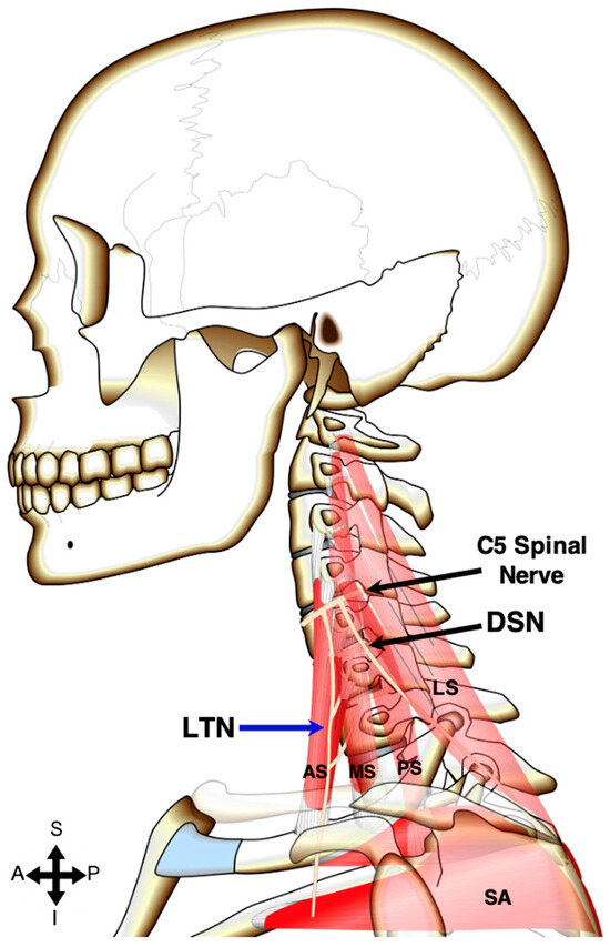Interconnected Anatomy and Clinical Relevance of the Dorsal Scapular ...