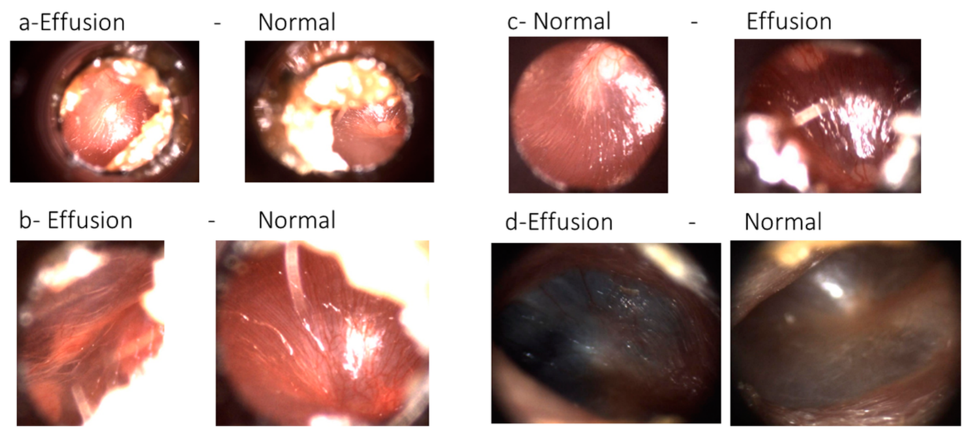 OtoPair: Combining Right and Left Eardrum Otoscopy Images to Improve ...