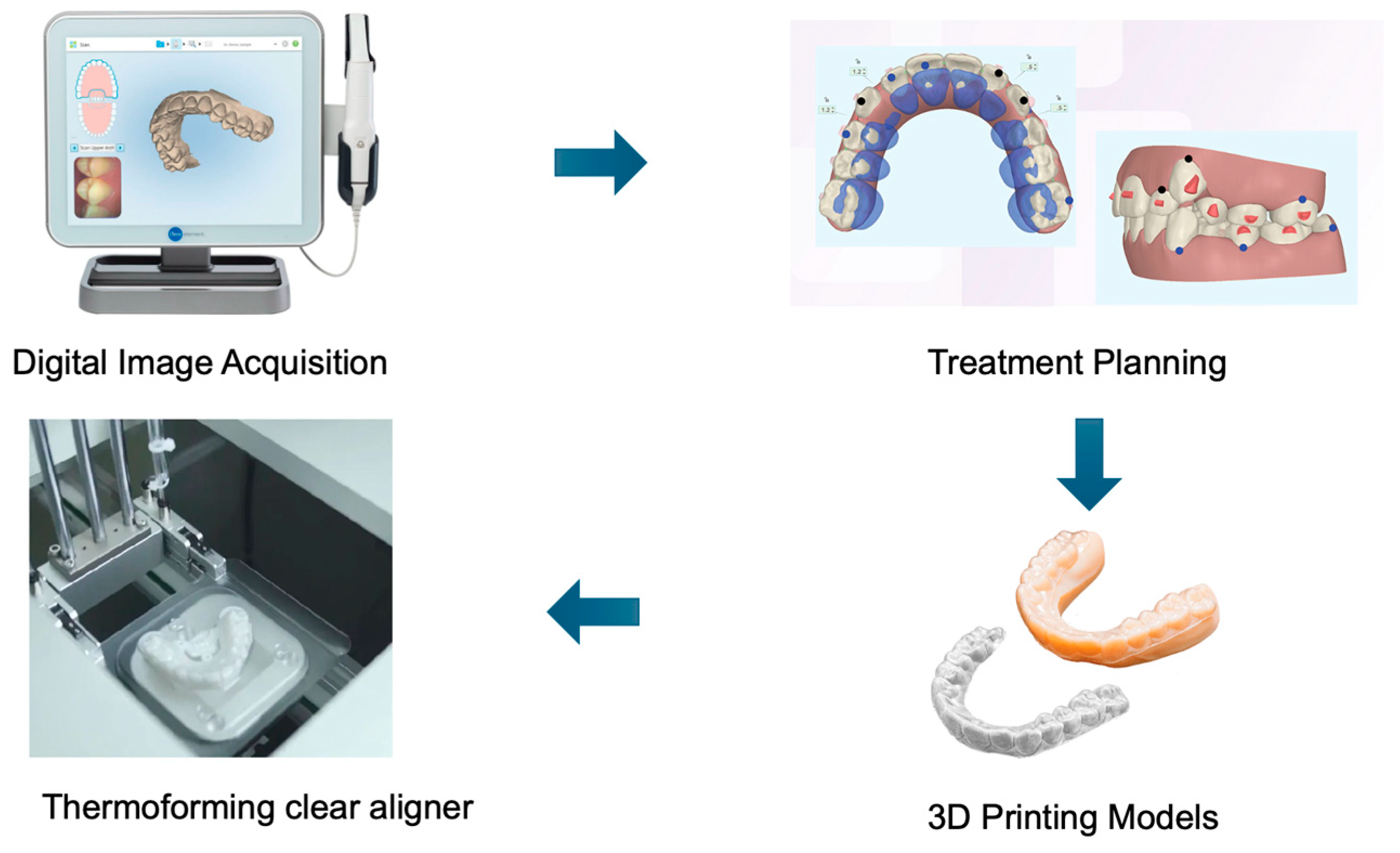 Materials for Clear Aligners—A Comprehensive Exploration of ...