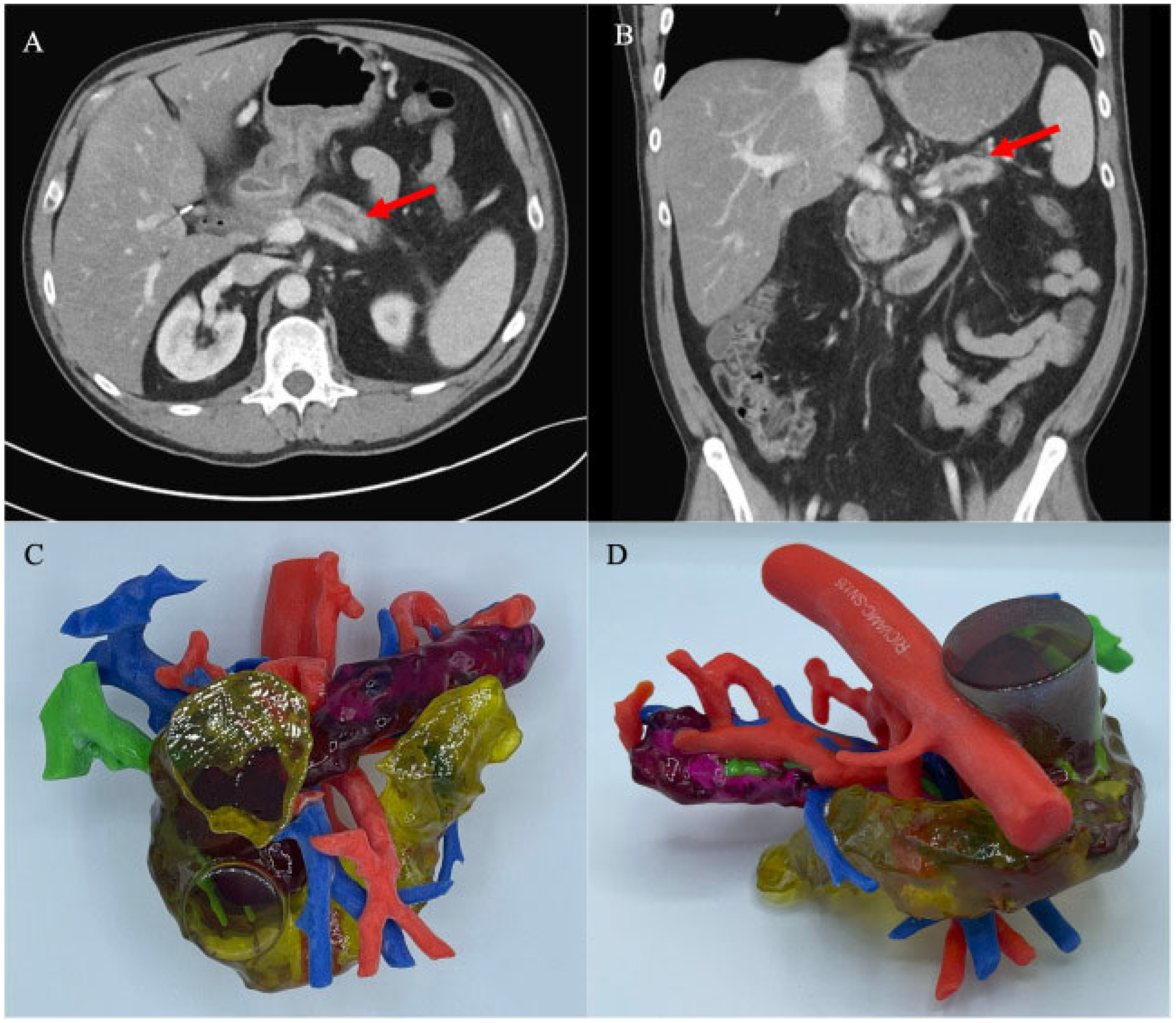 Three-Dimensional-Printed Gastrointestinal Tract Models for Surgical ...