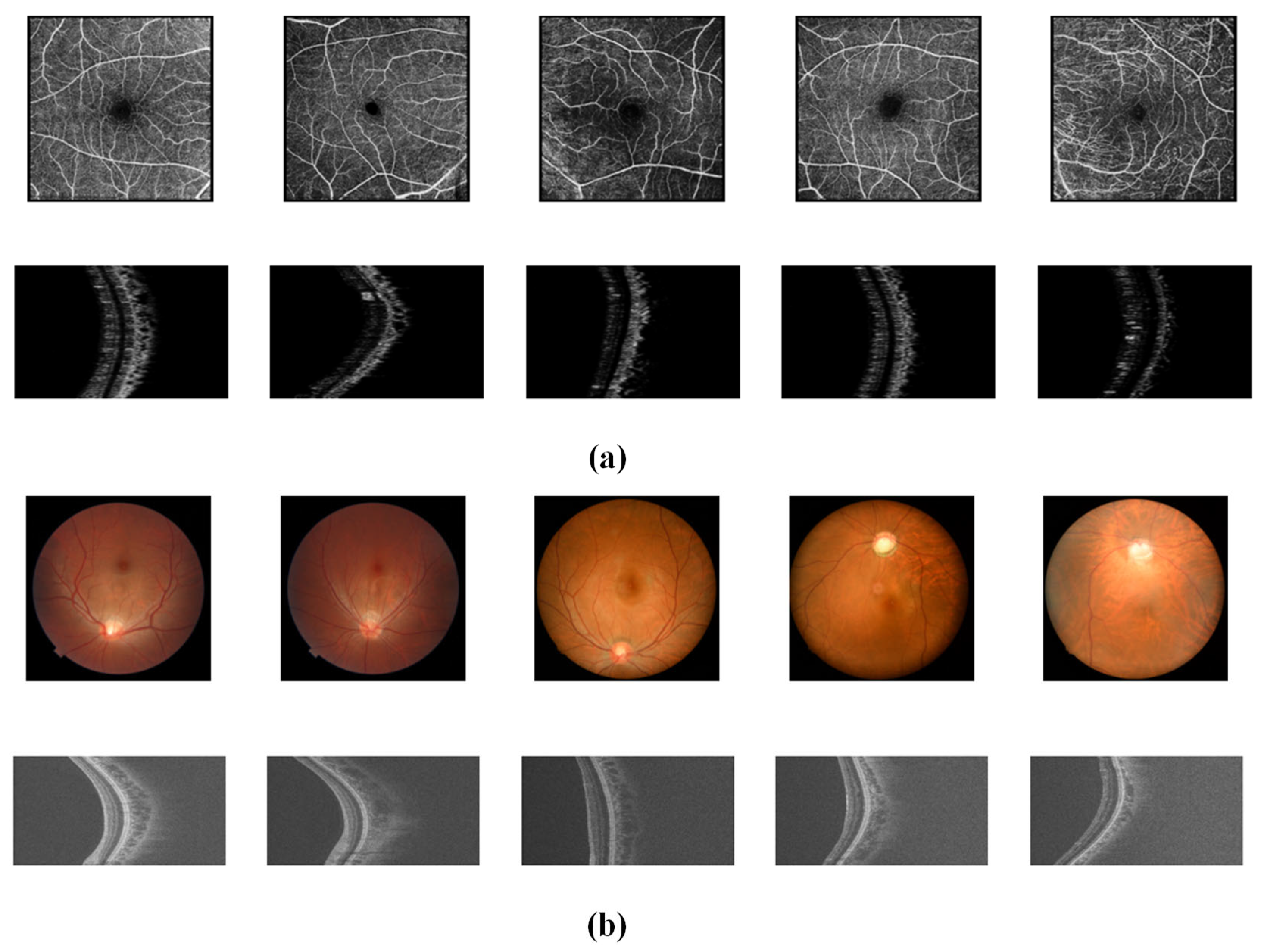 Dual-Branch Network with Hybrid Attention for Multimodal Ophthalmic ...