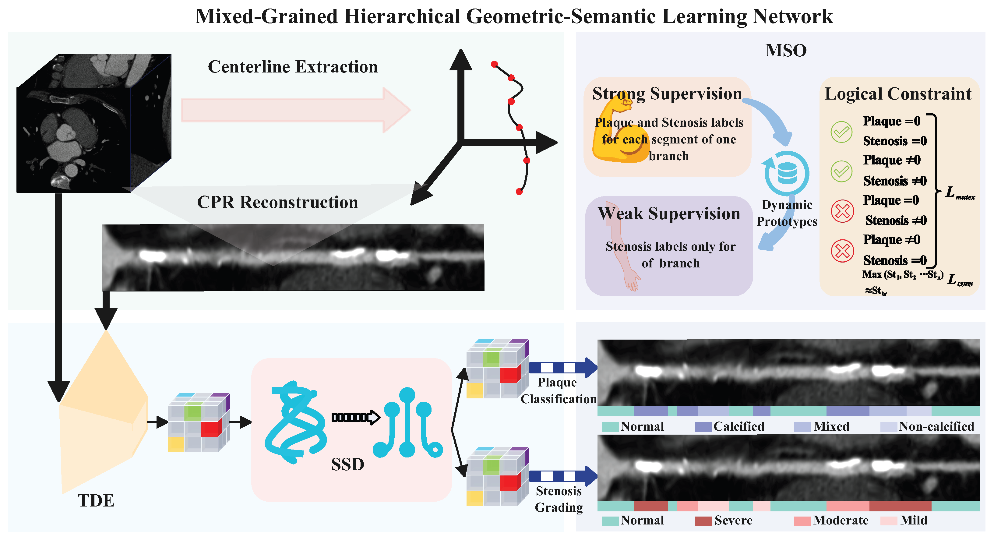MG-HGLNet: A Mixed-Grained Hierarchical Geometric-Semantic Learning ...