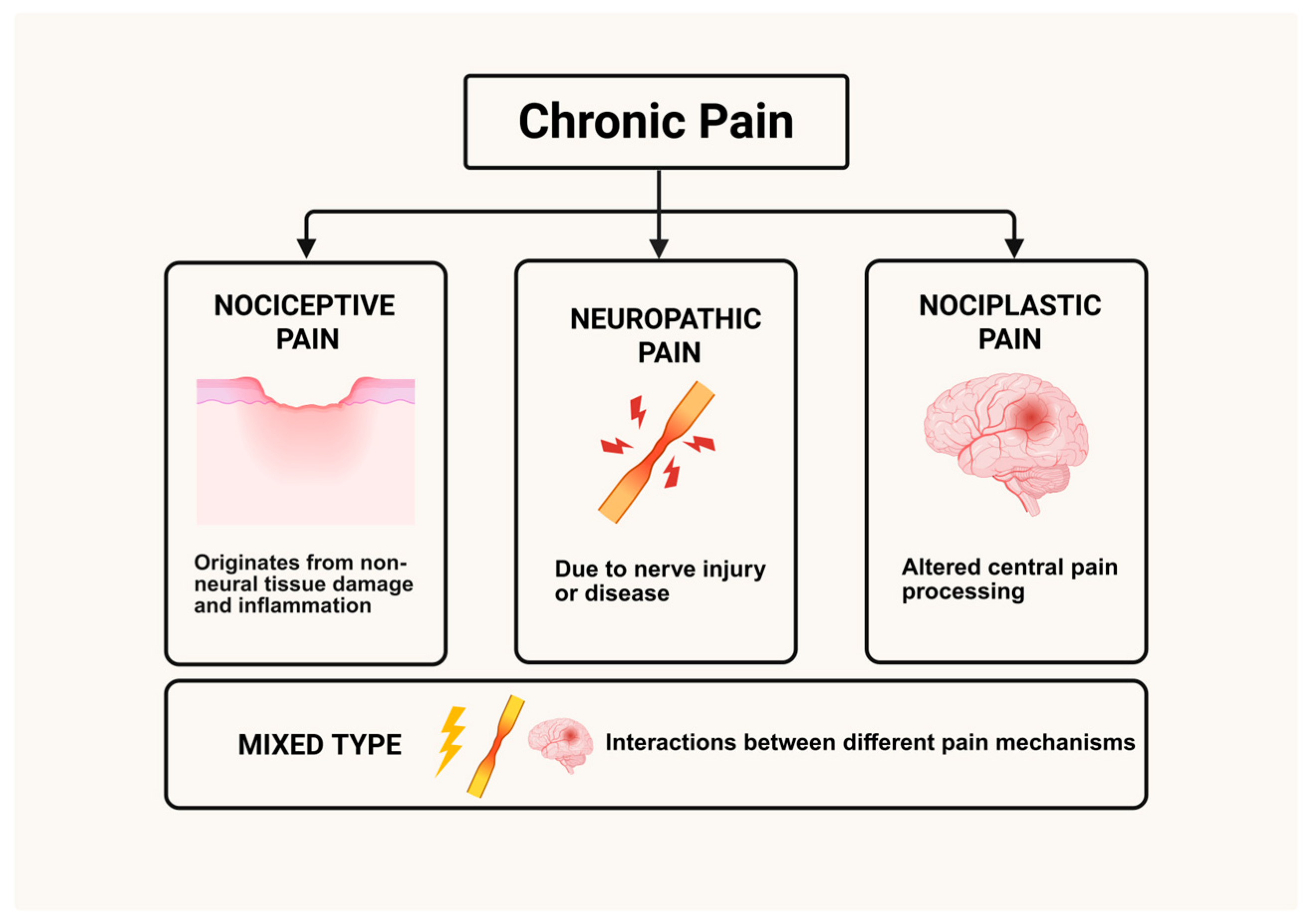 Pain Chronicity and Relief: From Molecular Basis to Exercise-Based ...