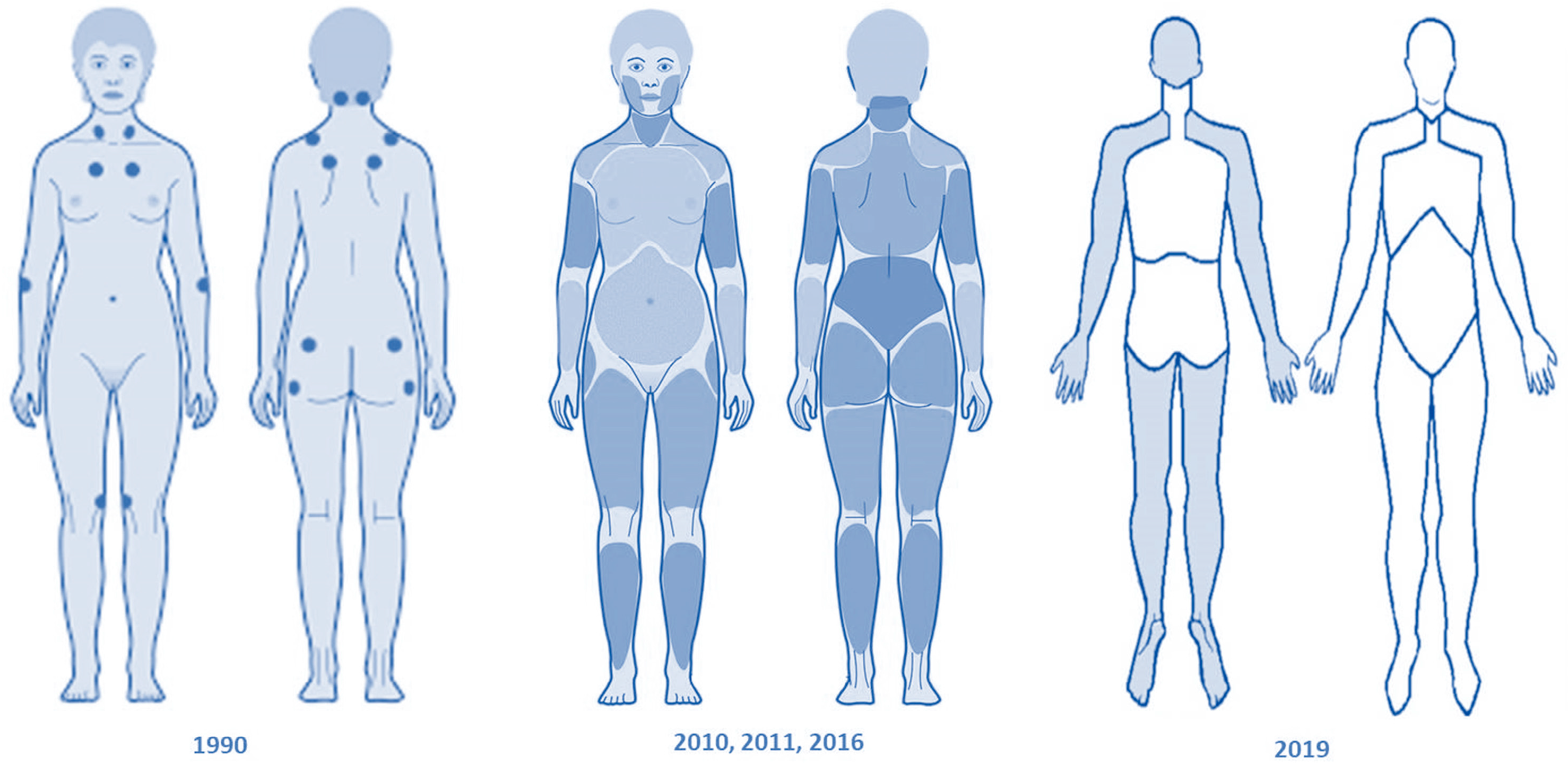 Fibromyalgia: A Review of the Pathophysiological Mechanisms and ...