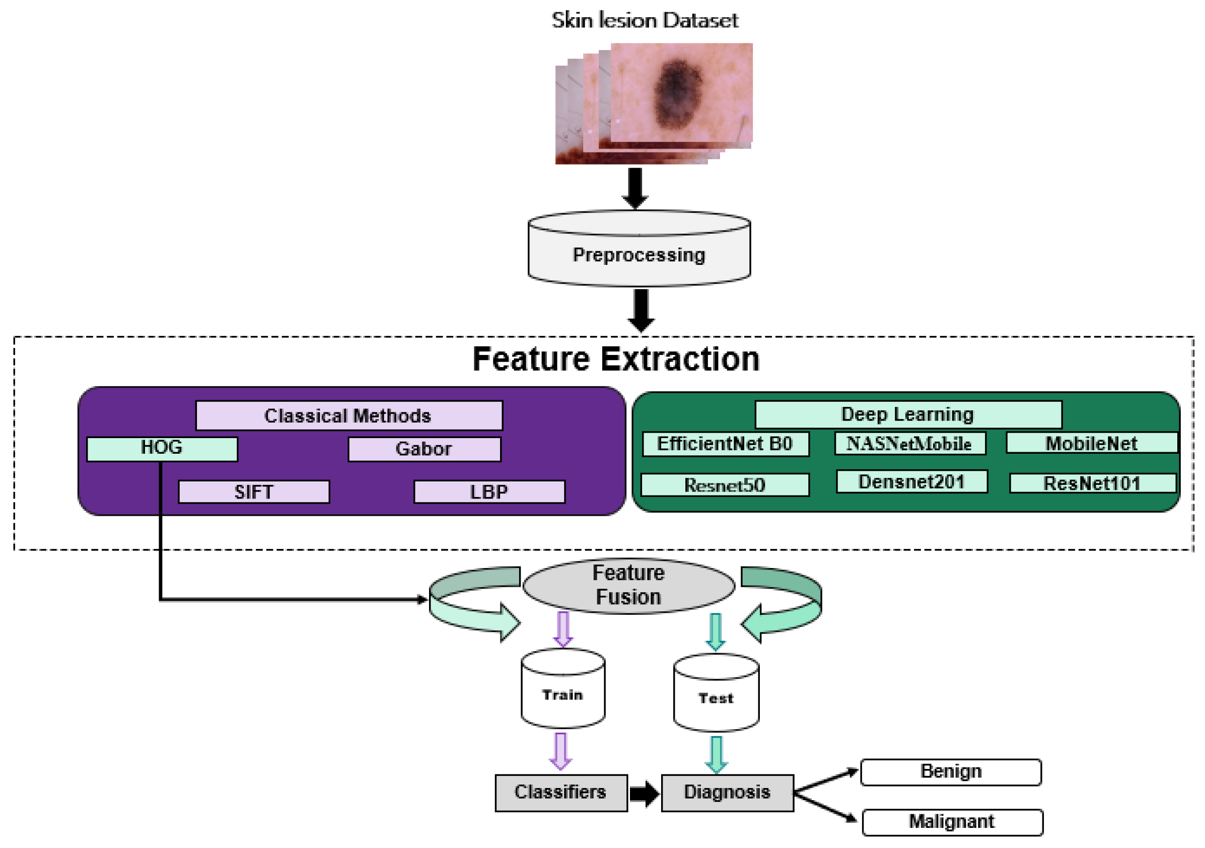 Skin Lesion Classification Using Hybrid Feature Extraction Based on ...