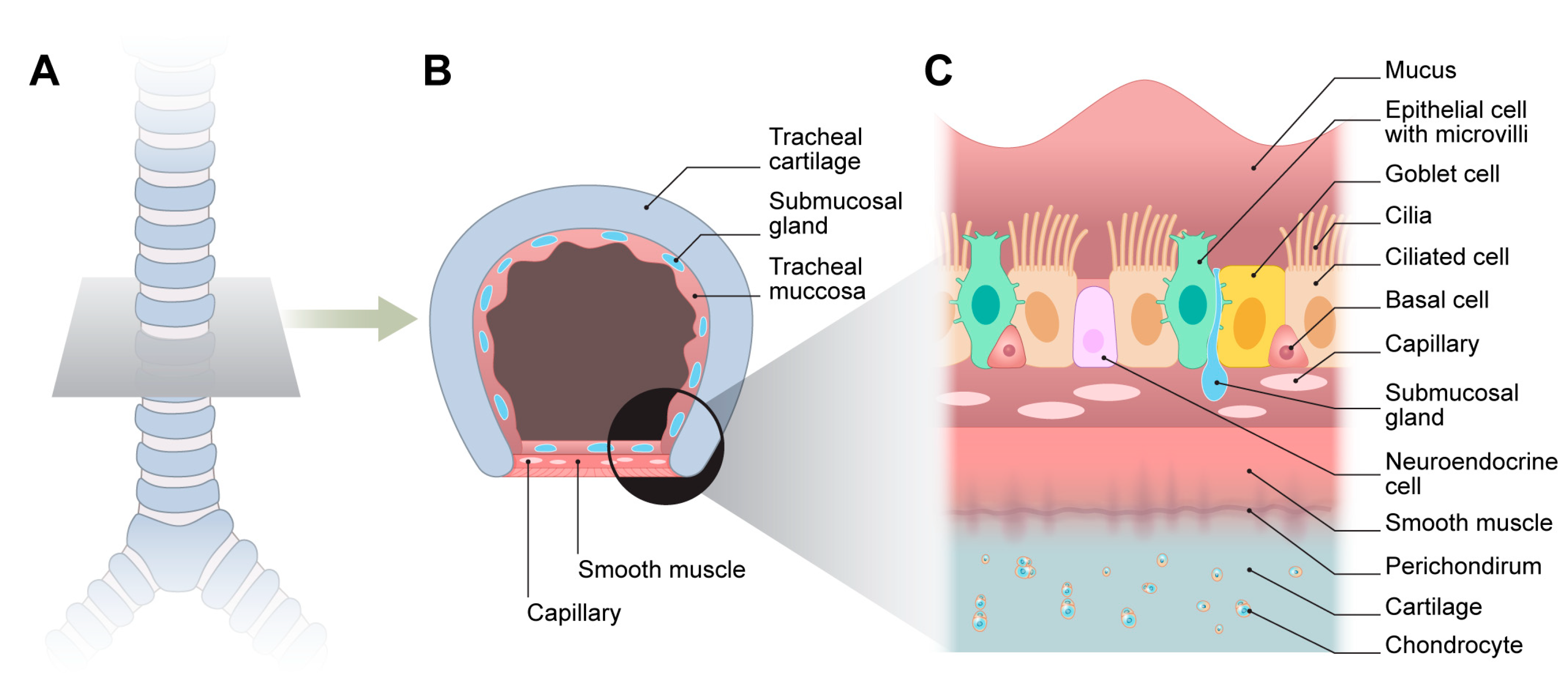 Tissue-Engineered Tracheal Reconstruction | MDPI