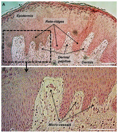 The Human Epidermal Basement Membrane: A Shaped and Cell Instructive ...