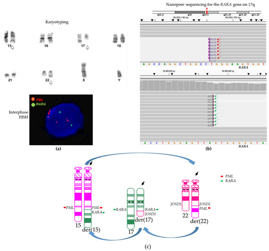 Rapid Detection of PML::RARA Fusions in Acute Promyelocytic Leukemia ...