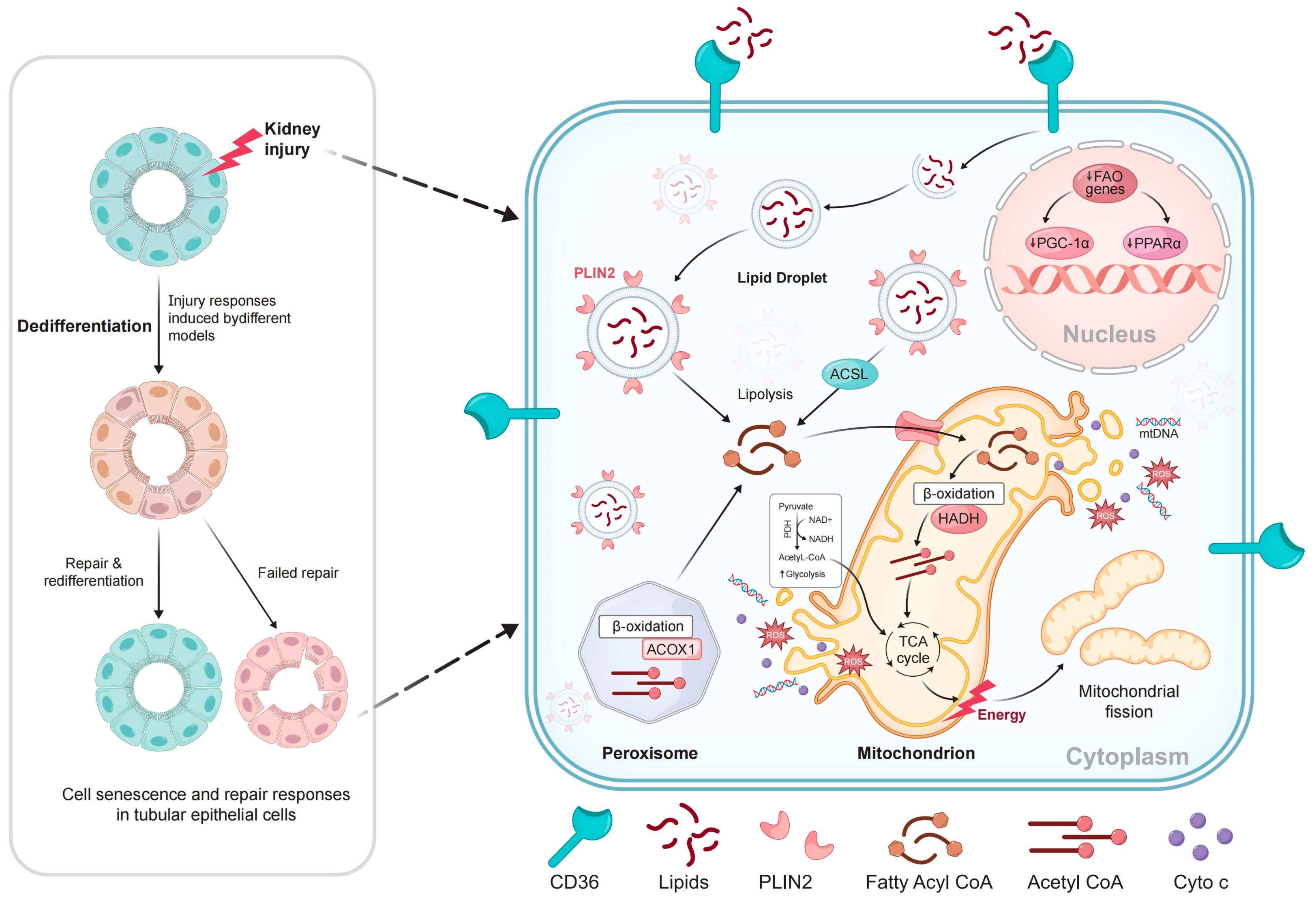 Mechanisms of Acute Kidney Injury–Chronic Kidney Disease Transition ...