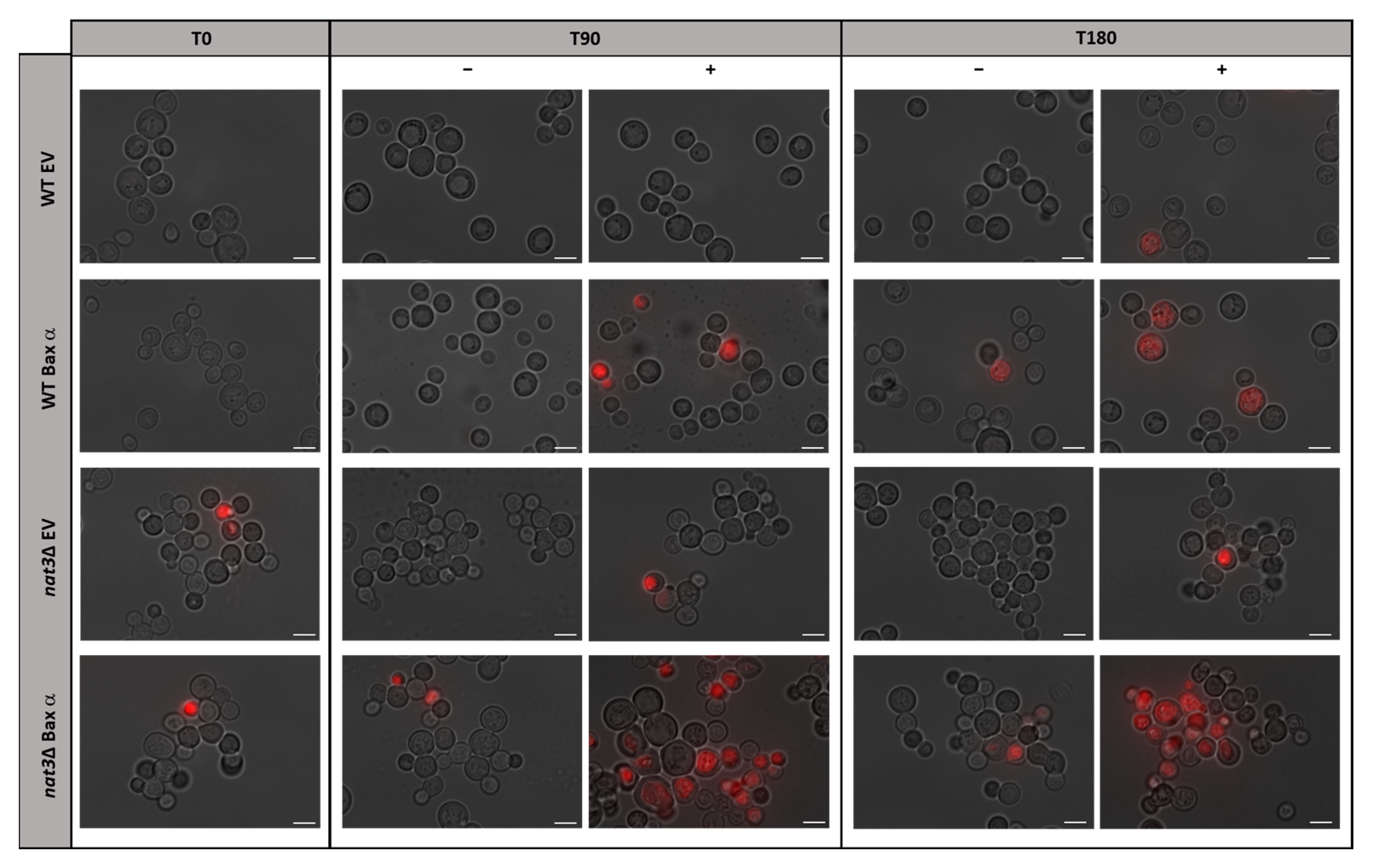 Yeast NatB Regulates Cell Death of Bax-Expressing Cells | MDPI
