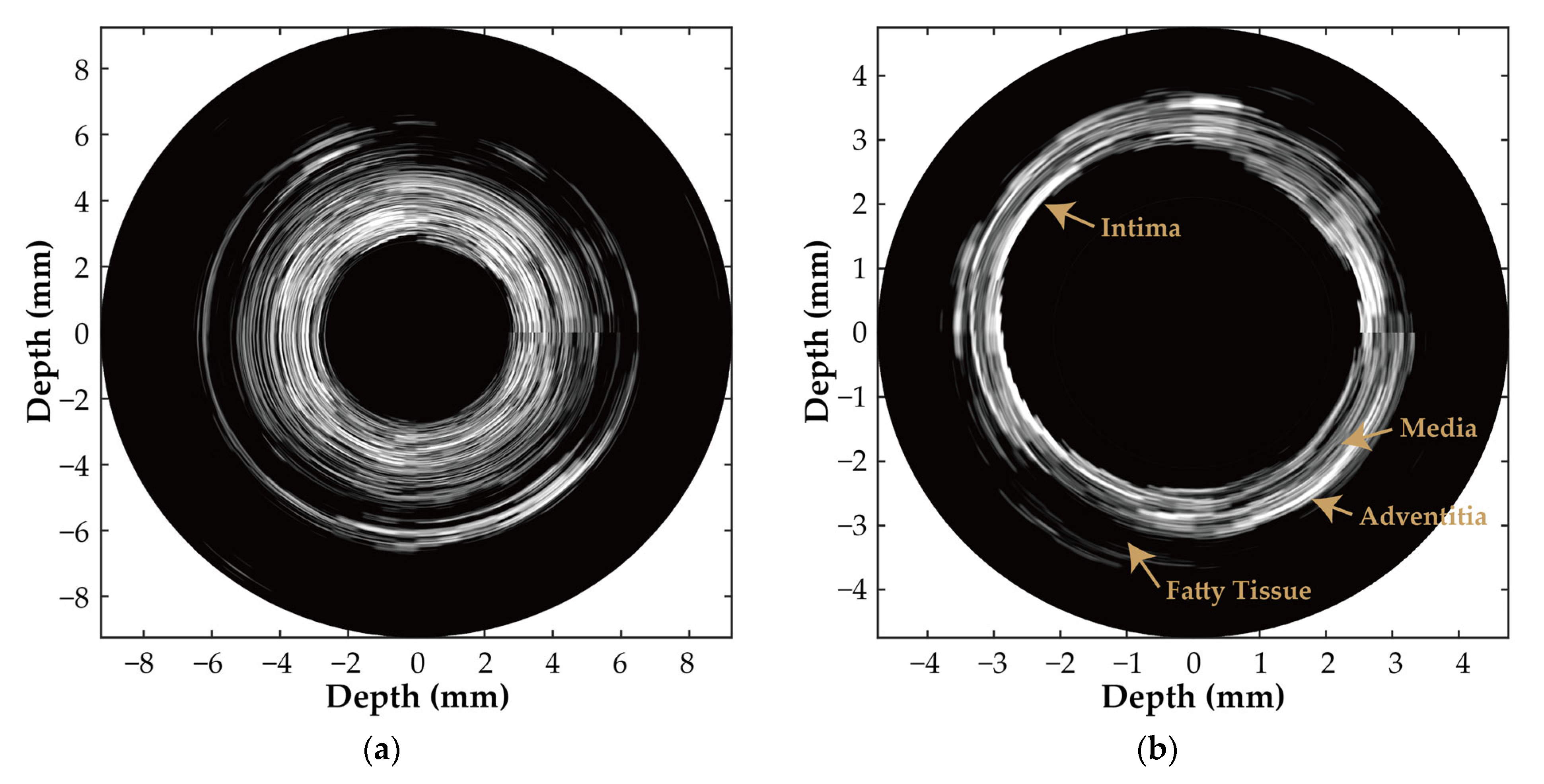 High-Frequency 64-Element Ring-Annular Array Transducer: Development ...