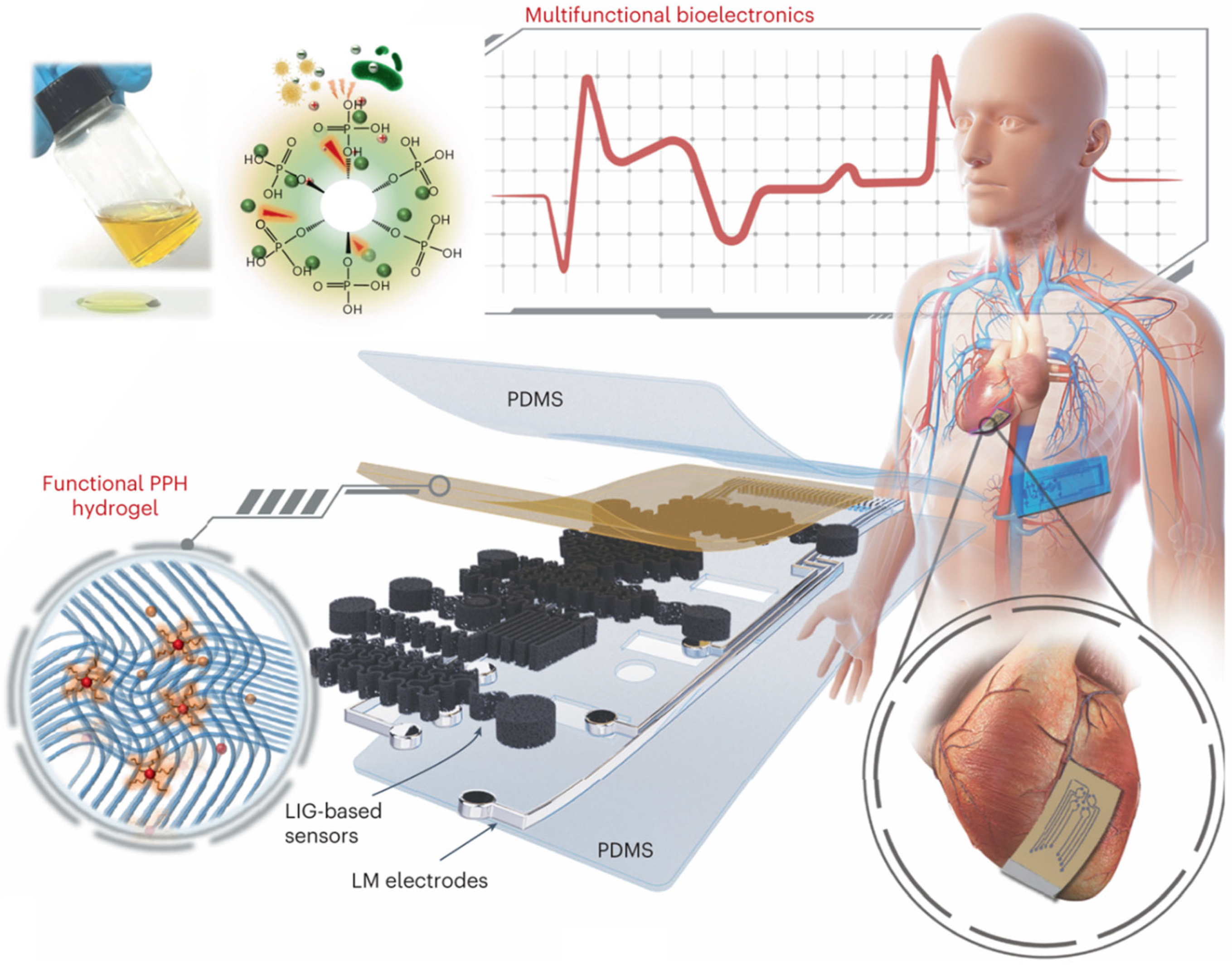 AI-Driven Wearable Bioelectronics in Digital Healthcare | MDPI