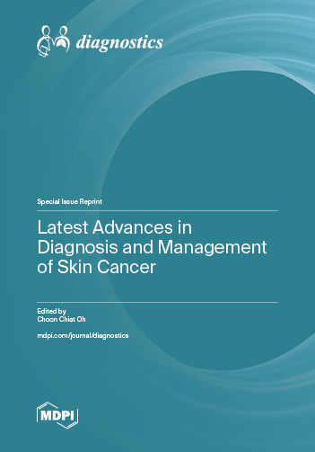 Latest Advances in Diagnosis and Management of Skin Cancer | MDPI Books