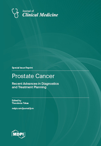Prostate Cancer | MDPI Books
