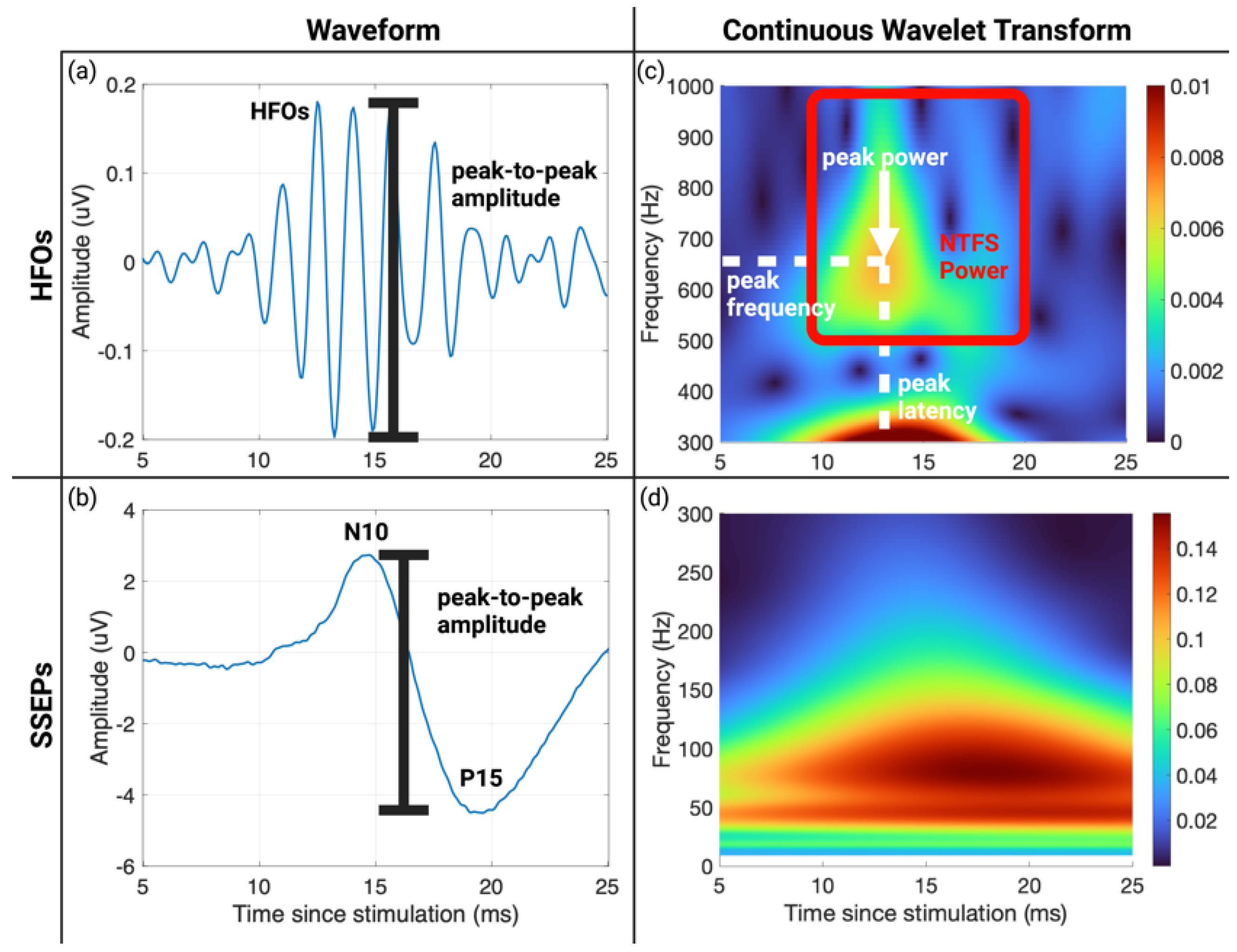 Time-Frequency Analysis of Somatosensory Evoked High-Frequency (600 Hz ...