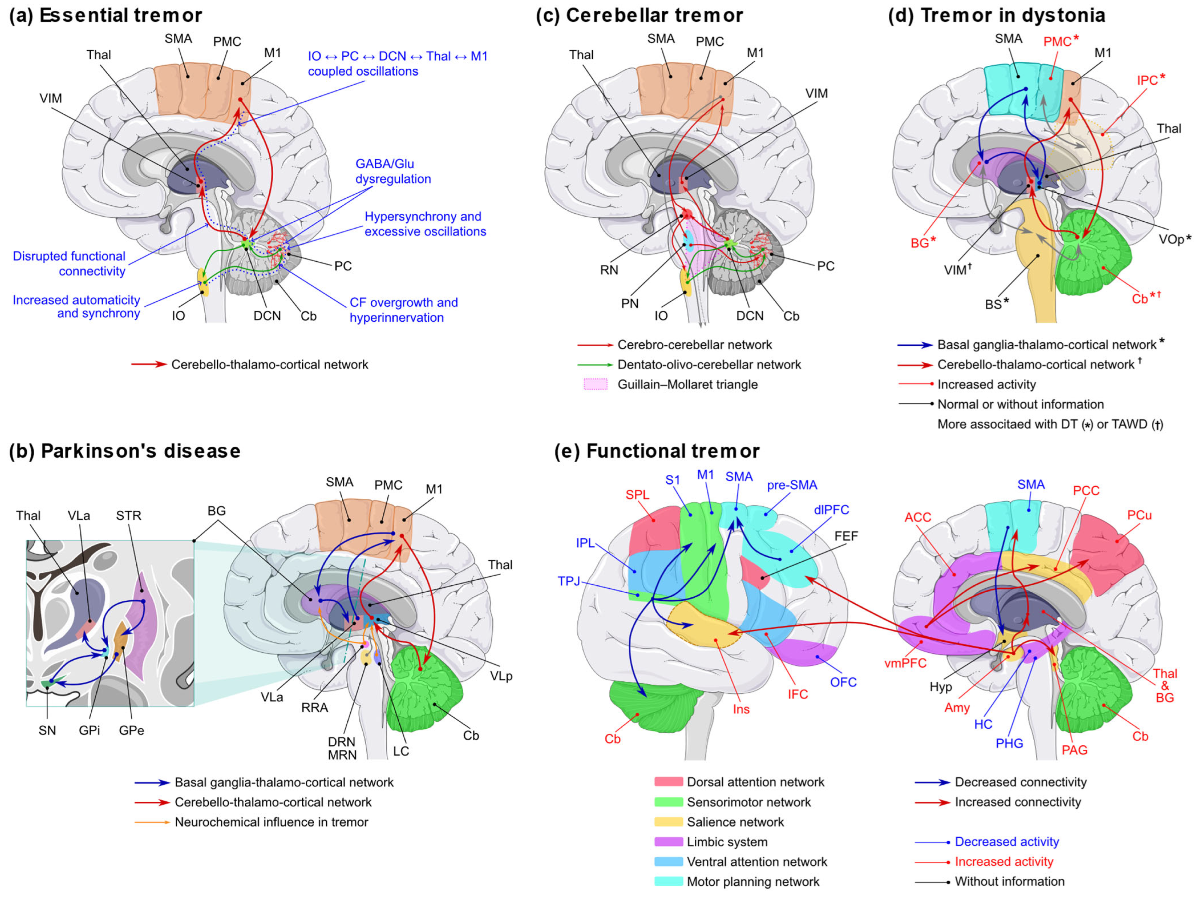 Tremor: Clinical Frameworks, Network Dysfunction and Therapeutics | MDPI