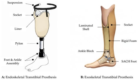 Prosthesis | Open Access Journal | MDPI