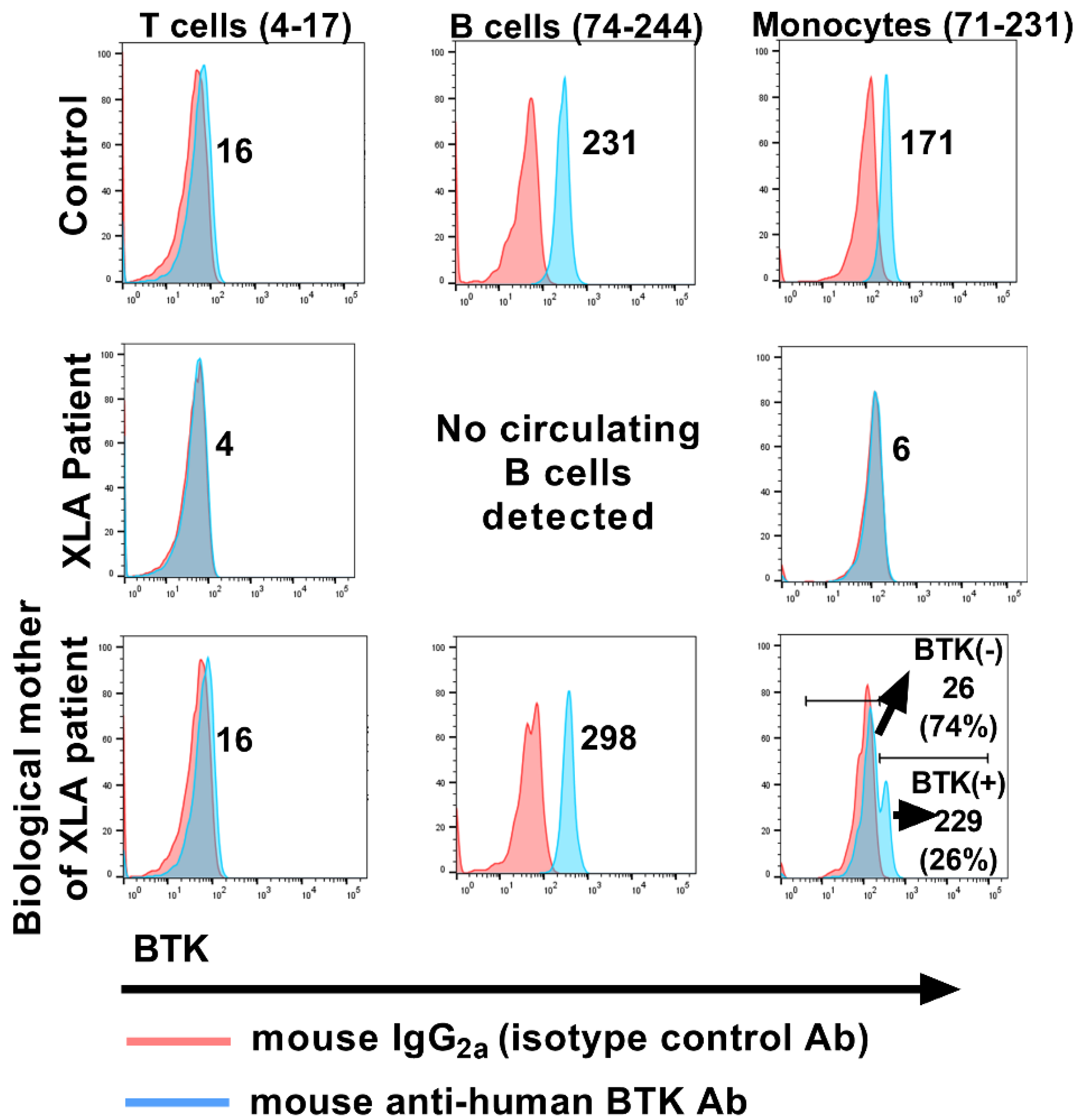 Clinical Aspects of B Cell Immunodeficiencies: The Past, the Present ...