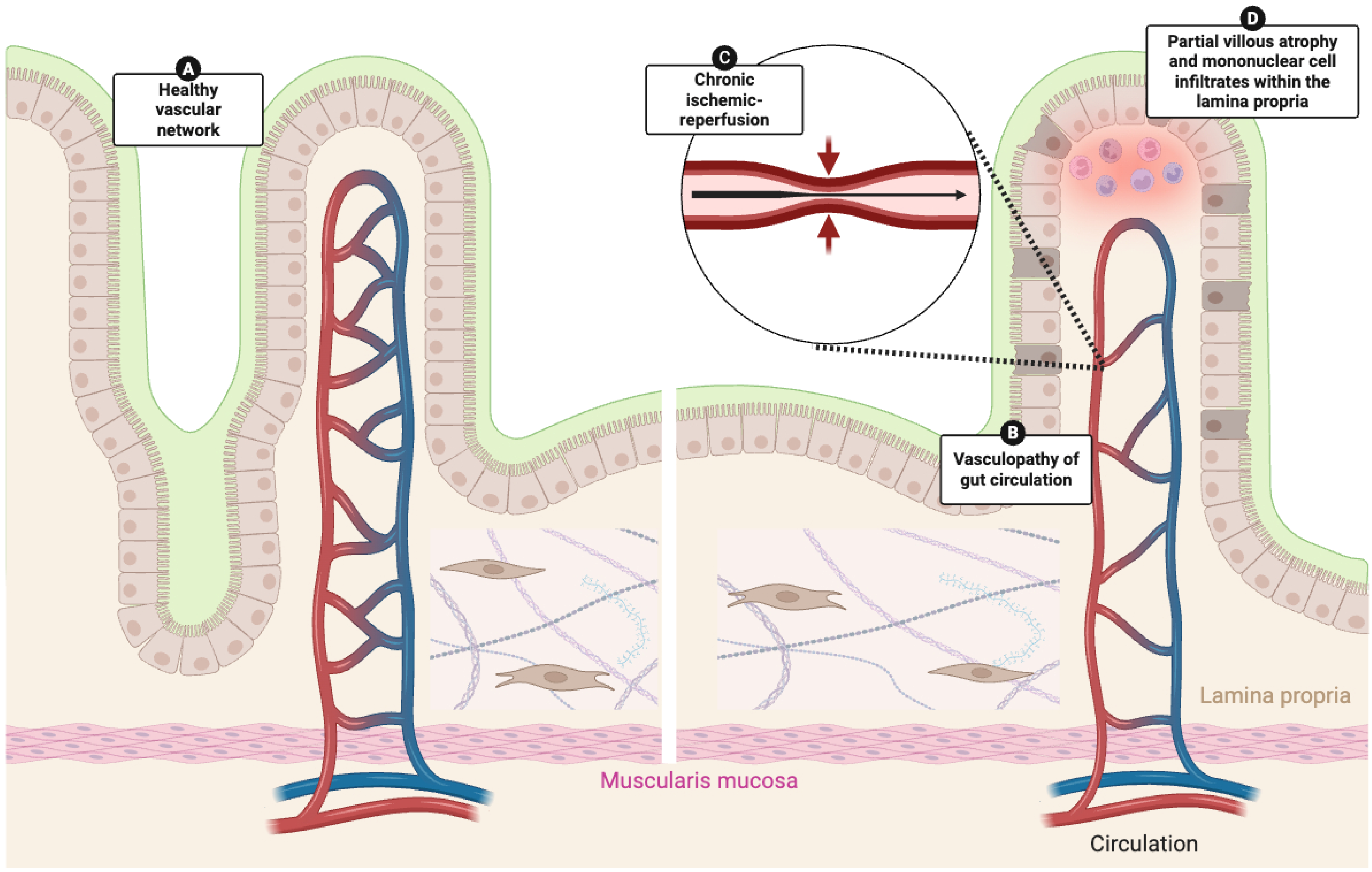 Cellular Players in Gastrointestinal Involvement of Systemic Sclerosis ...