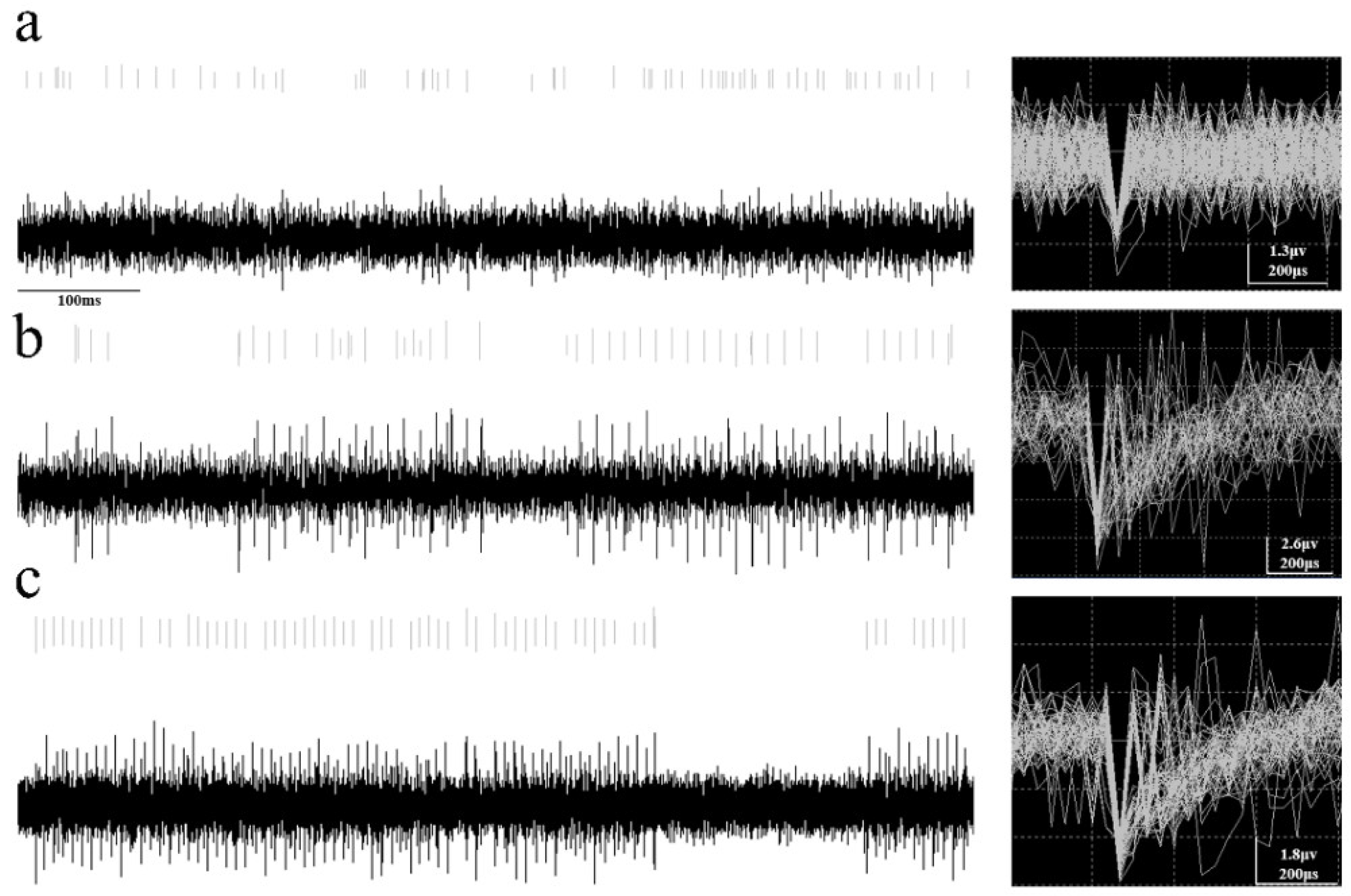 A Taste Bud Organoid-Based Microelectrode Array Biosensor for Taste ...