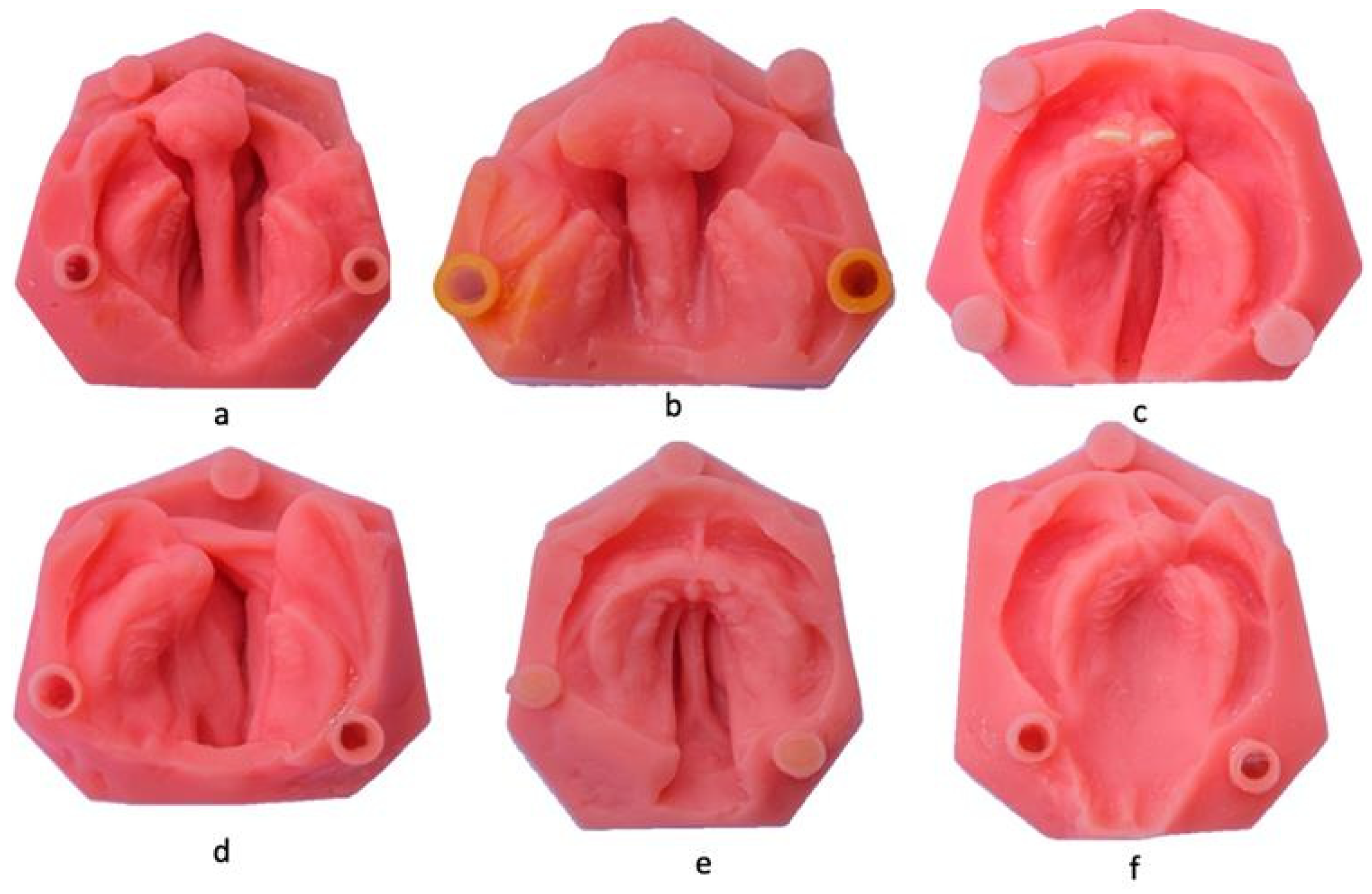 Enhancing Effective Scanning Techniques for Digital Impression in ...