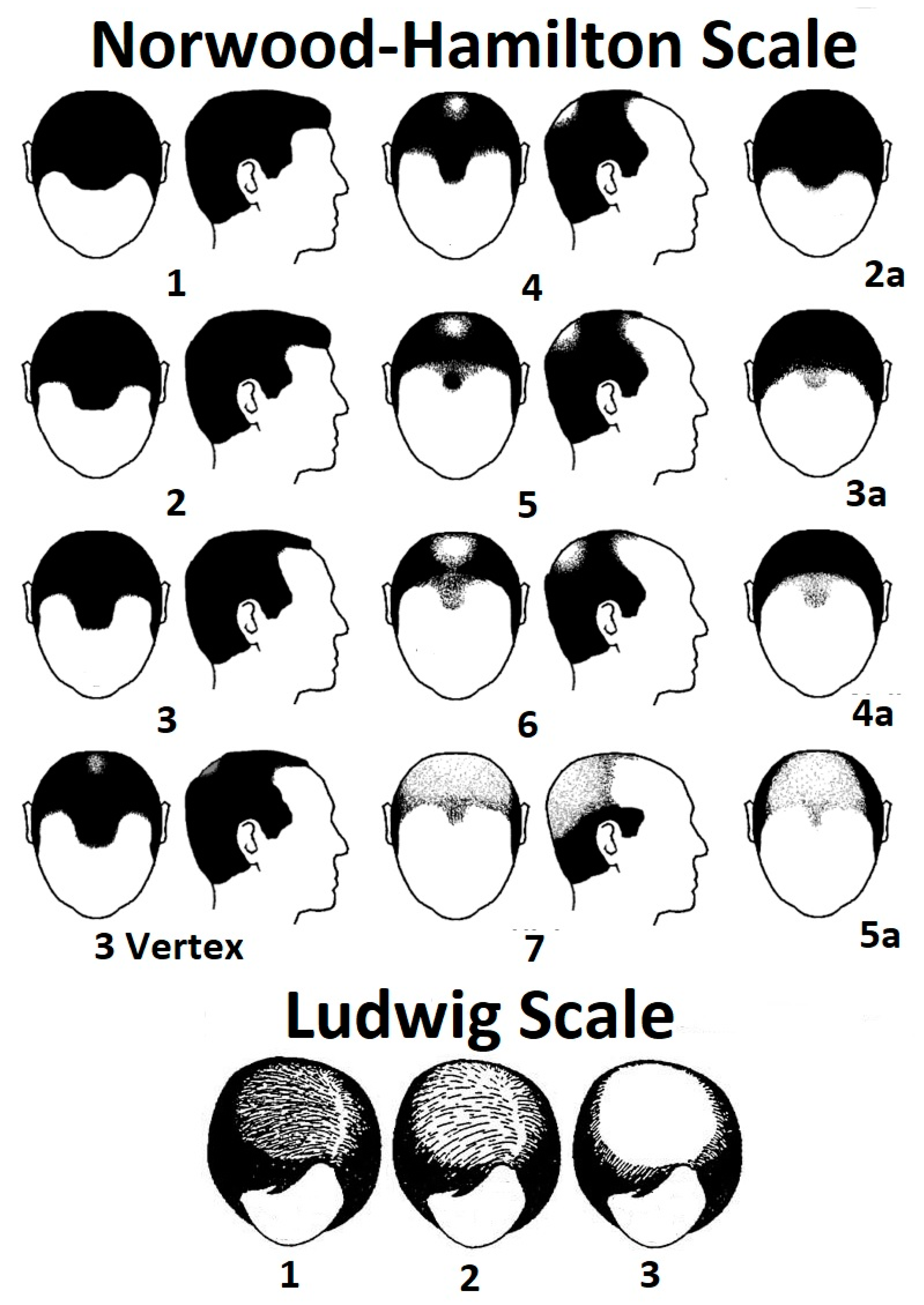An Updated Etiology of Hair Loss and the New Cosmeceutical Paradigm in ...