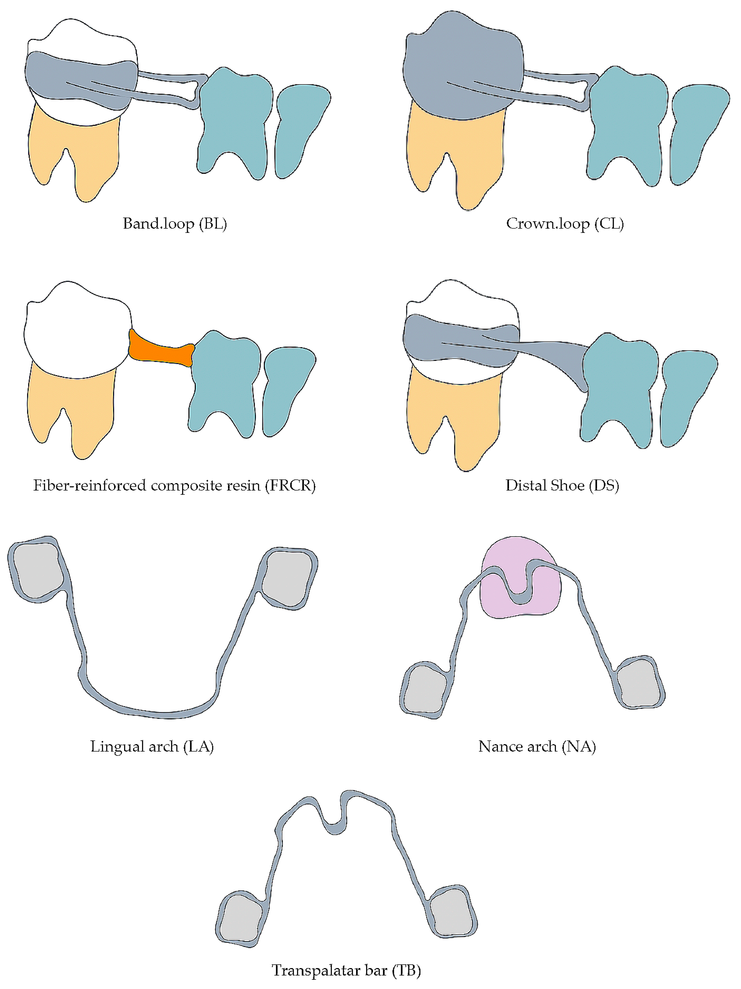 Effectiveness of Space Maintainers in Pediatric Patients: A Systematic ...