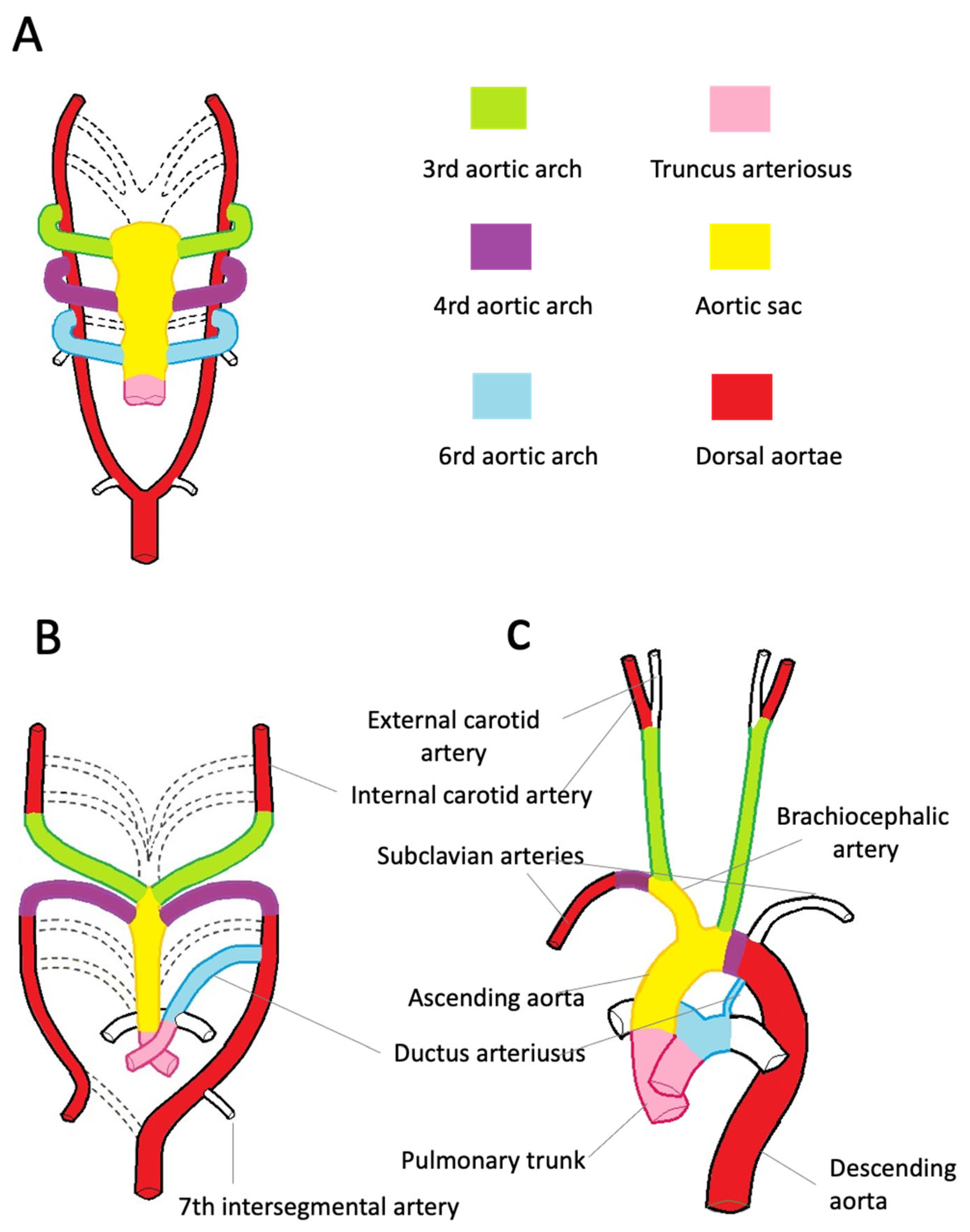 Thoracic Aorta: Anatomy and Pathology | MDPI