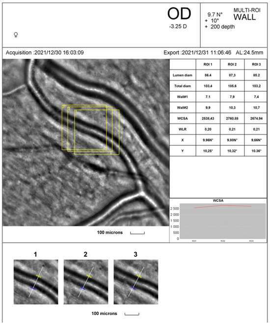 Retinal Microcirculation Measurements in Response to Endurance ...