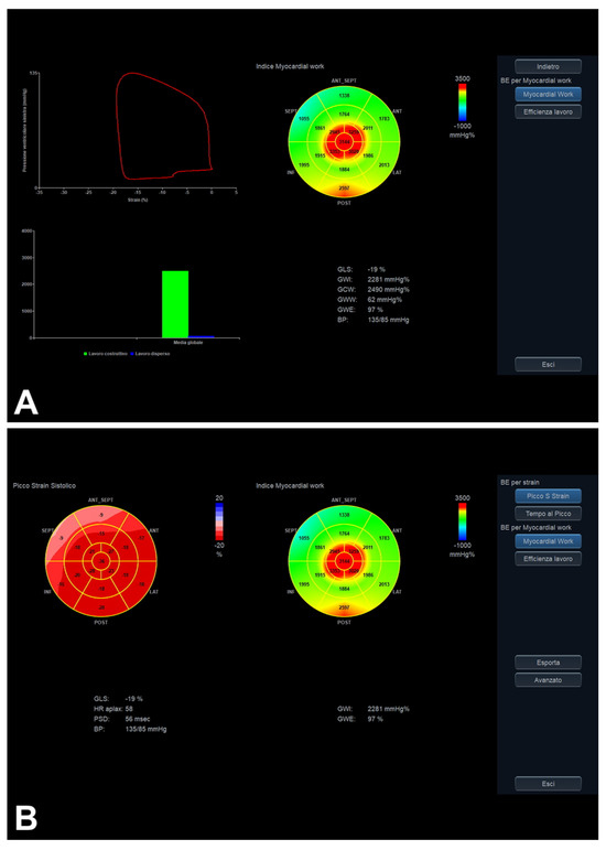 Echocardiographic Assessment of Left Ventricular Diastolic Function in ...