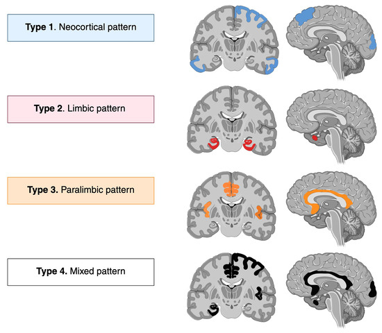 Abnormal Magnetic Resonance Imaging Patterns in Patients with ...