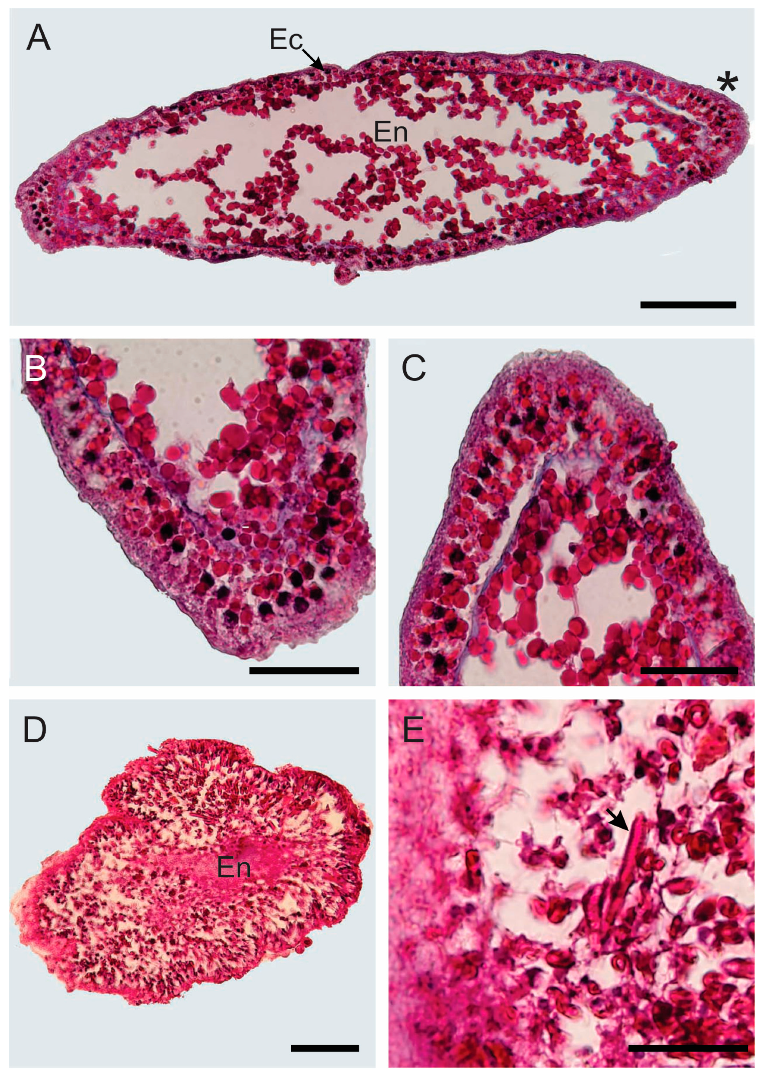 Morphological and Molecular Identification of Porpita porpita (Hydrozoa ...