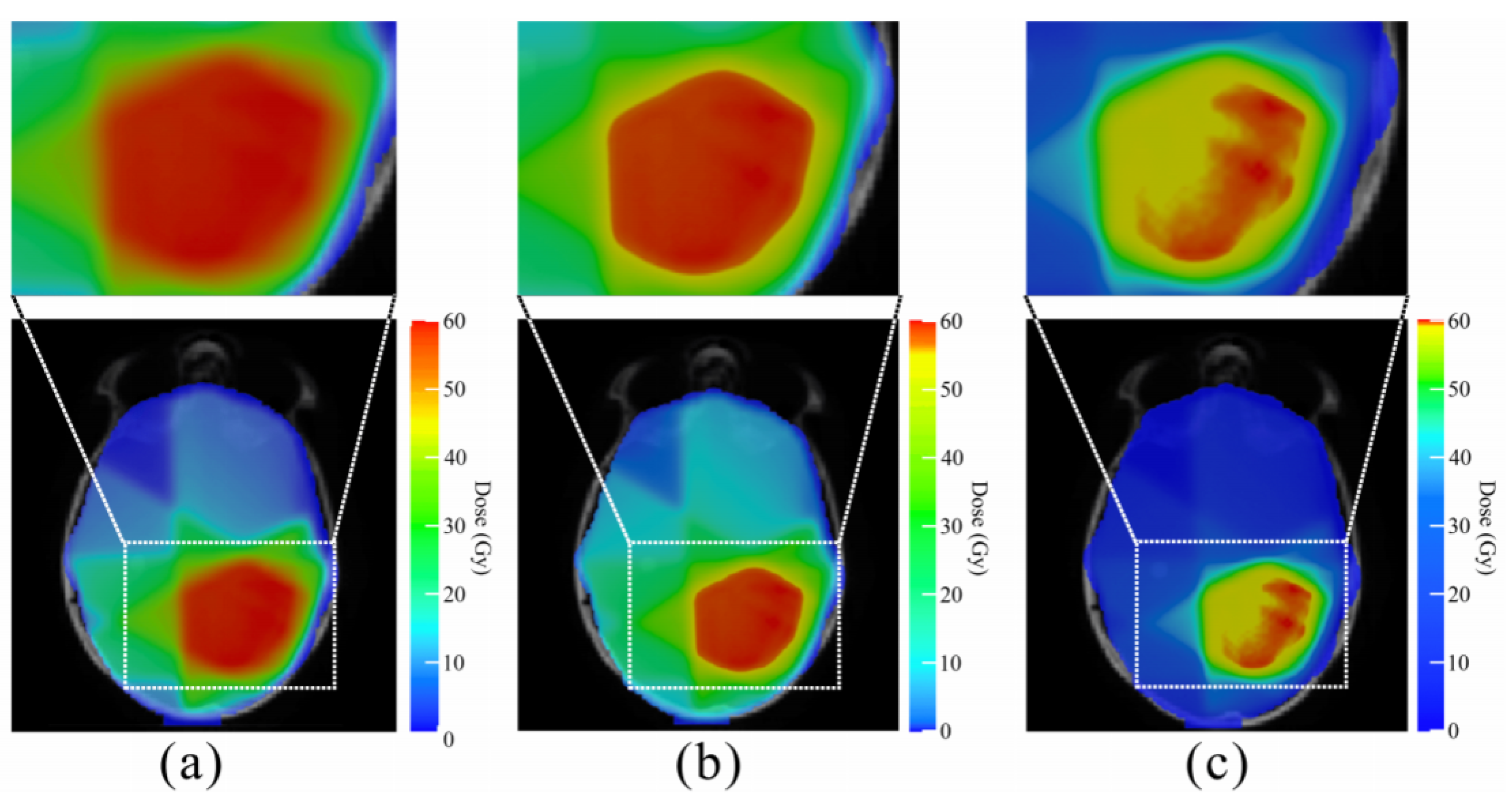 Research Progress of Tumor Big Data Visualization | MDPI