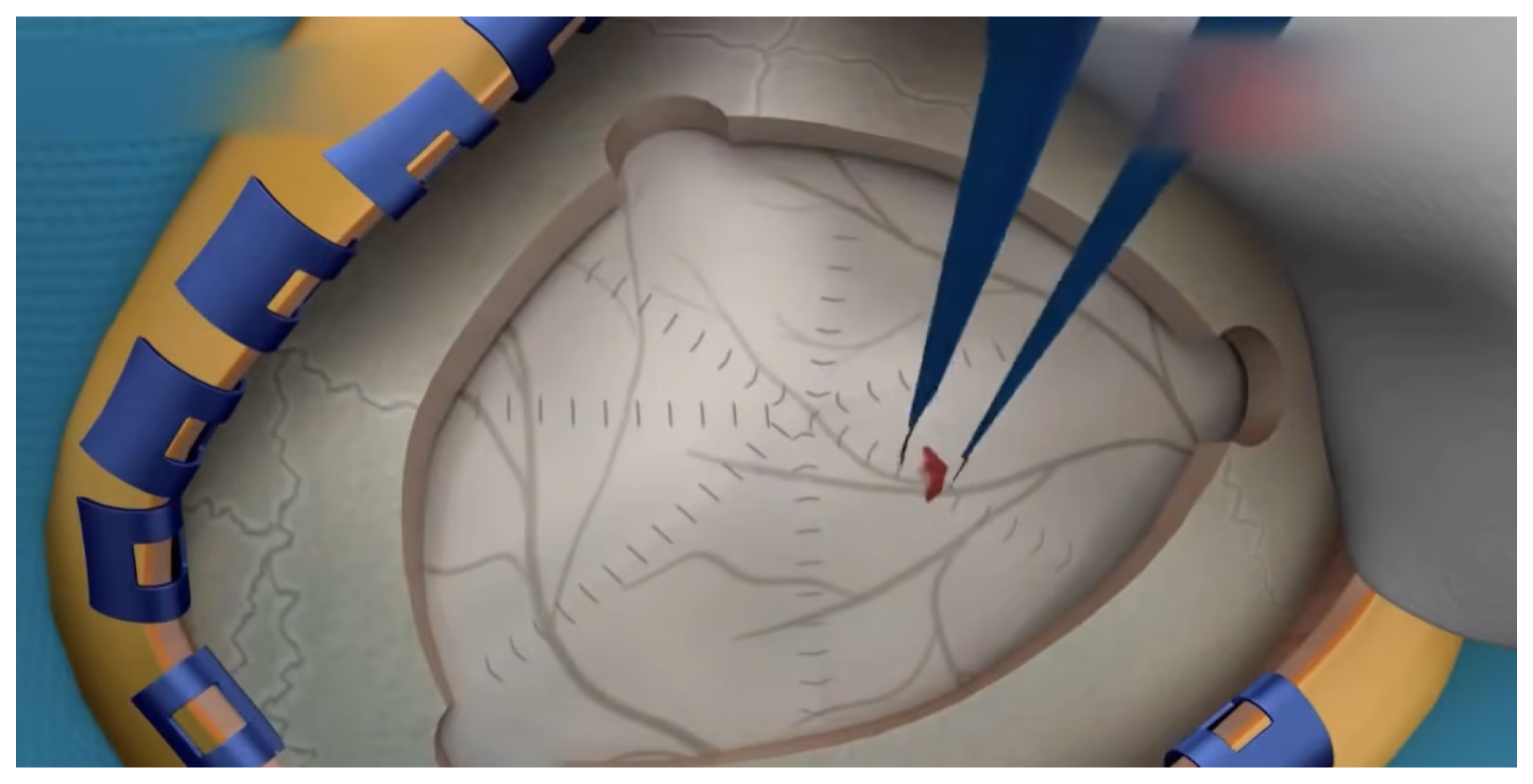Research Progress of Tumor Big Data Visualization | MDPI