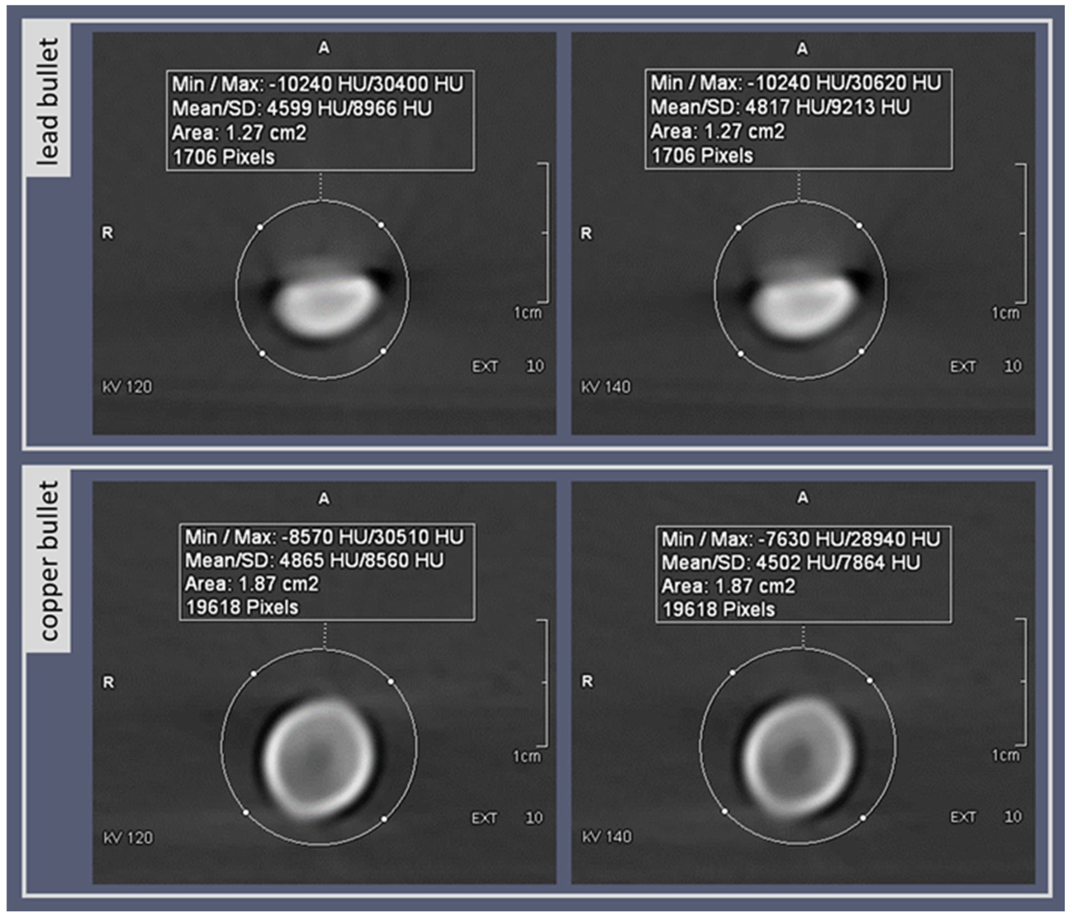 Virtual Bullet Examination: Forensic Insights from CT Imaging in ...