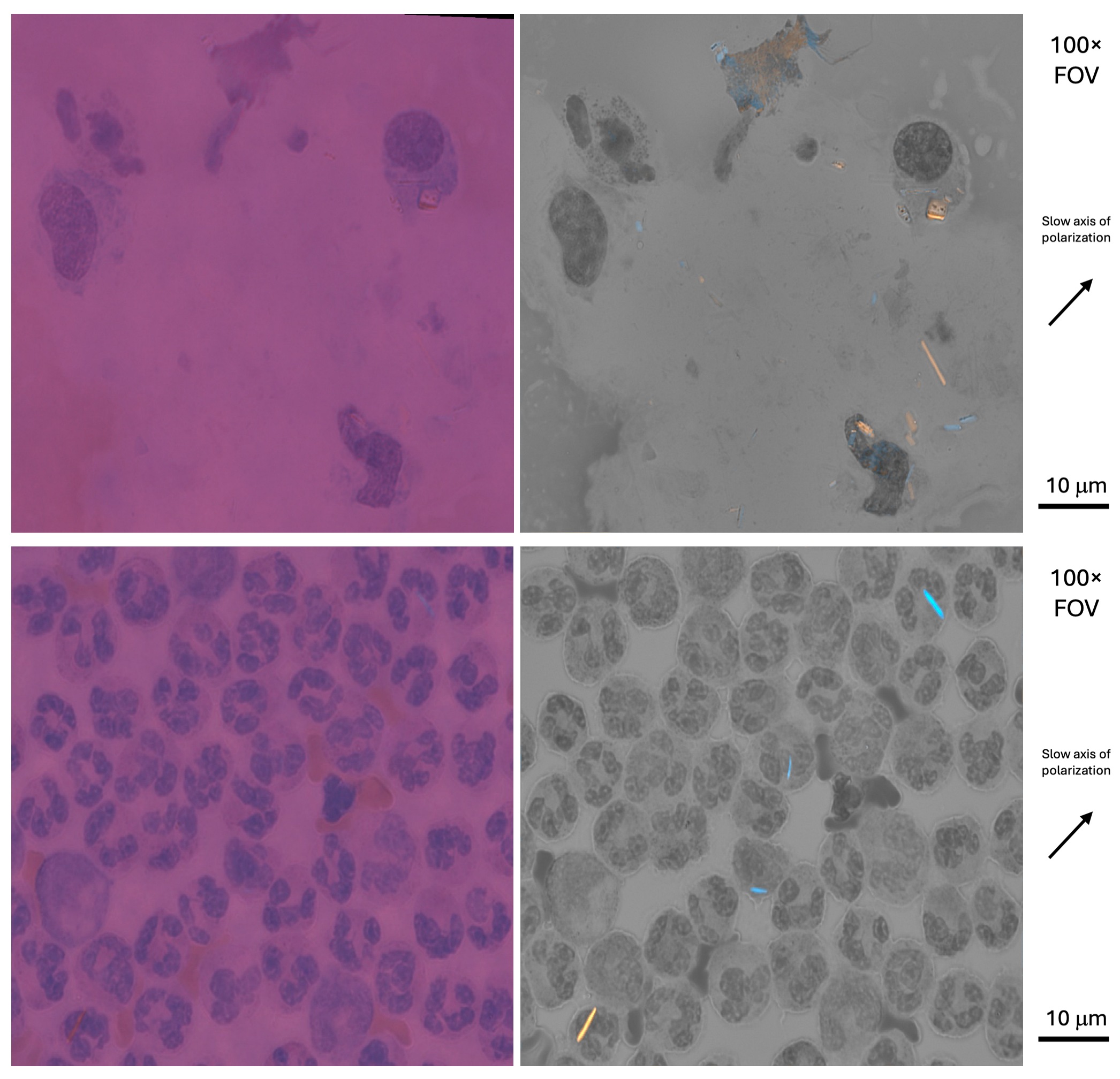 A Novel Polarized Light Microscope for the Examination of Birefringent ...