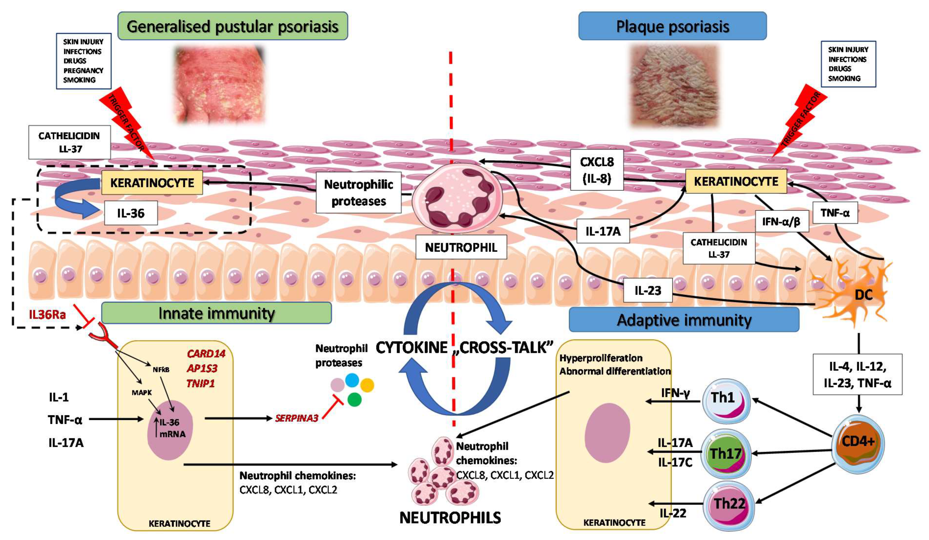 Generalized Pustular Psoriasis: Divergence of Innate and Adaptive ...