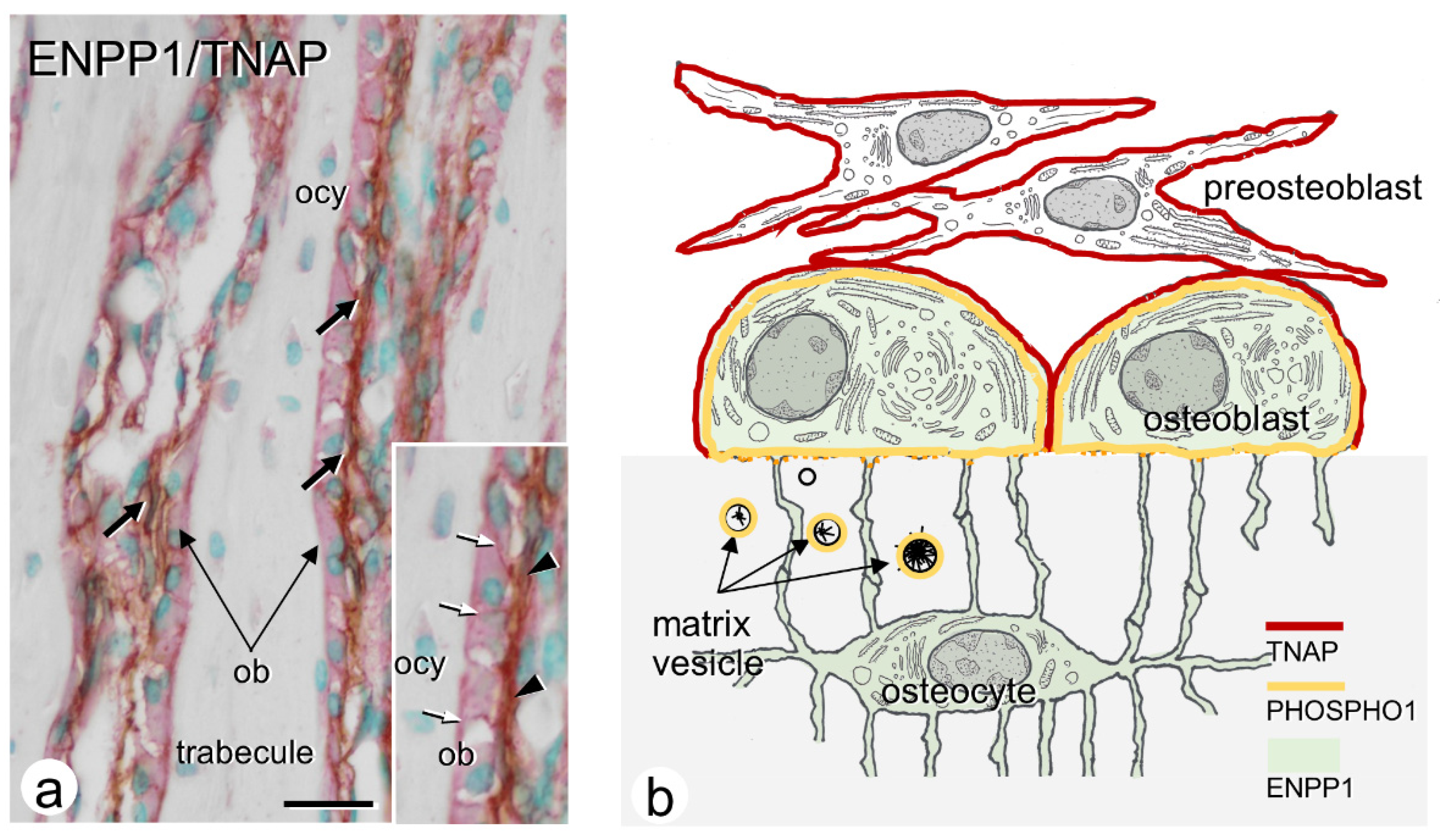 Matrix Vesicle-Mediated Mineralization and Osteocytic Regulation of ...