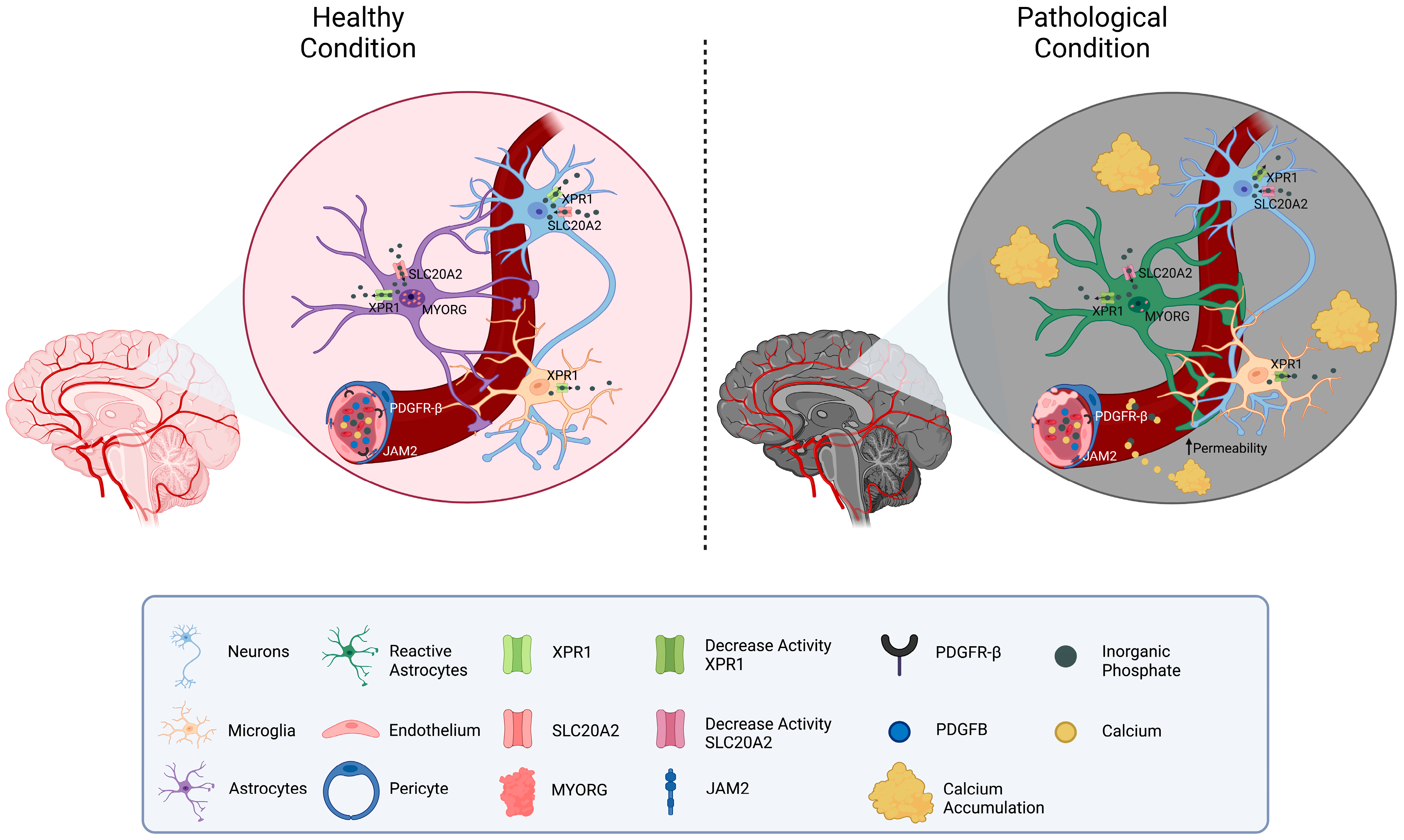 Brain Calcifications: Genetic, Molecular, and Clinical Aspects | MDPI