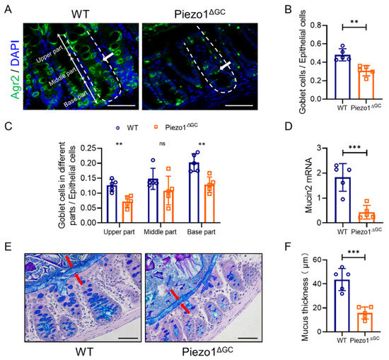 Slowed Intestinal Transit Induced by Less Mucus in Intestinal Goblet ...