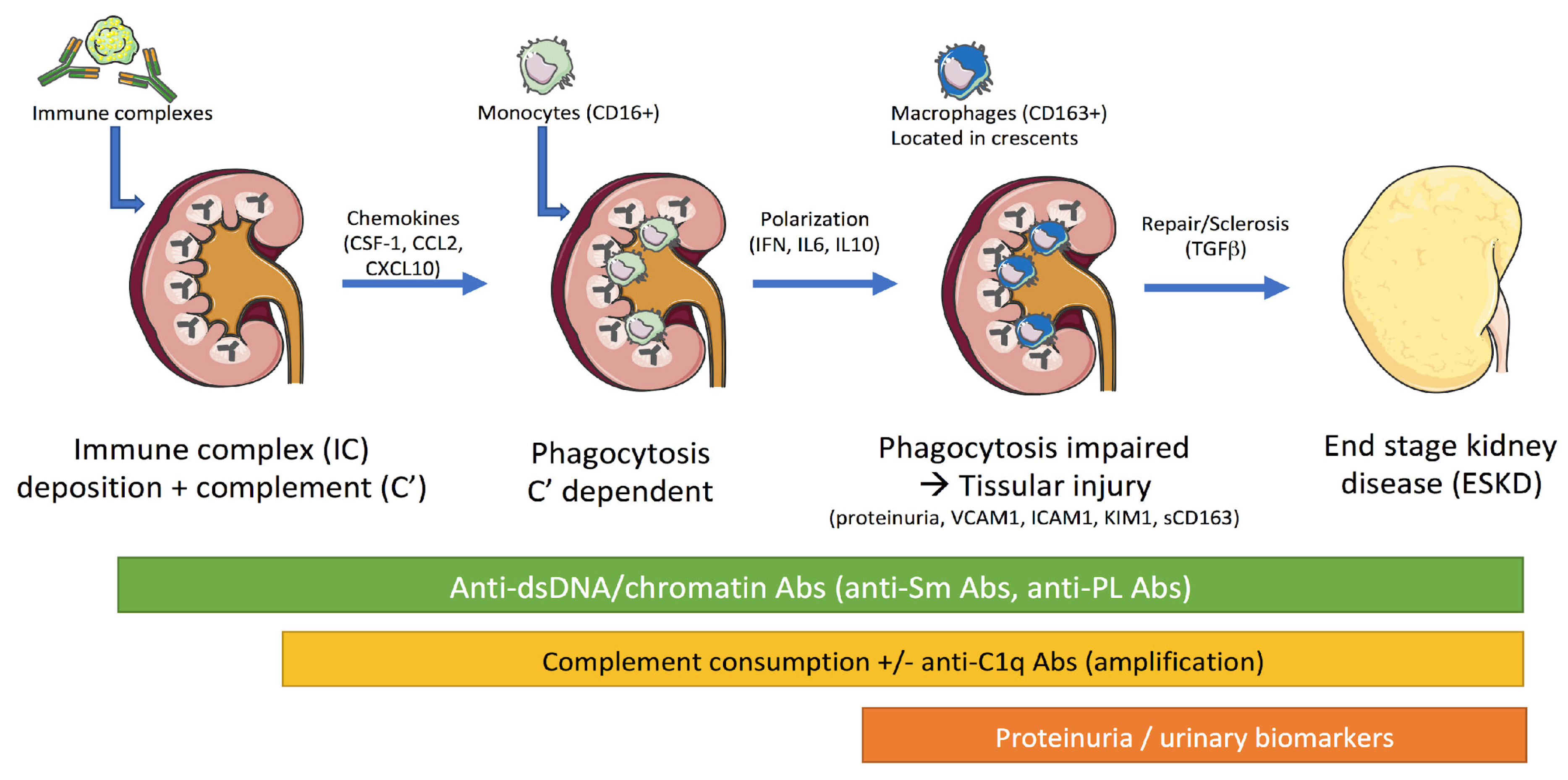 Lupus Nephritis Risk Factors and Biomarkers: An Update | MDPI