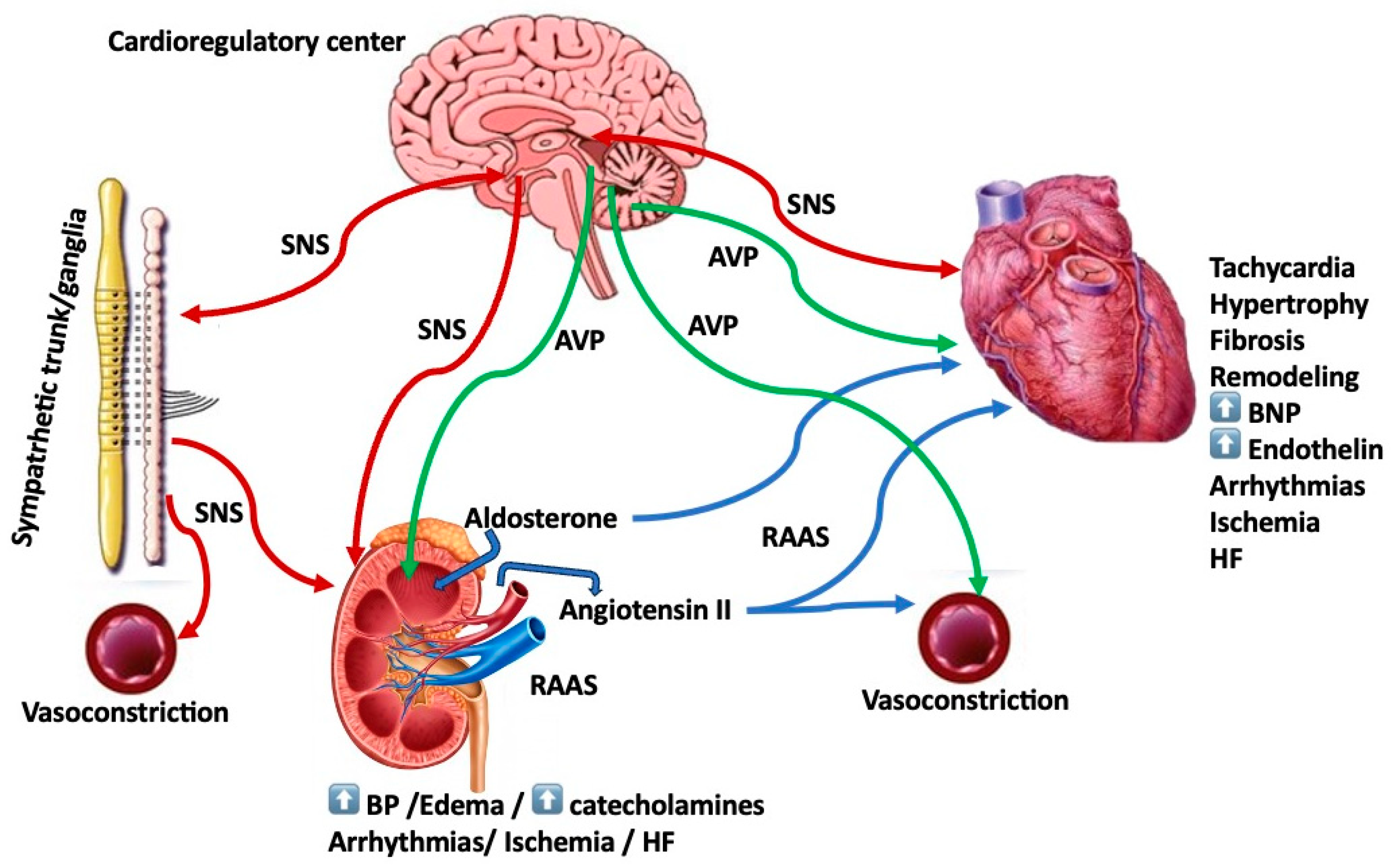 Neurohumoral Activation in Heart Failure | MDPI