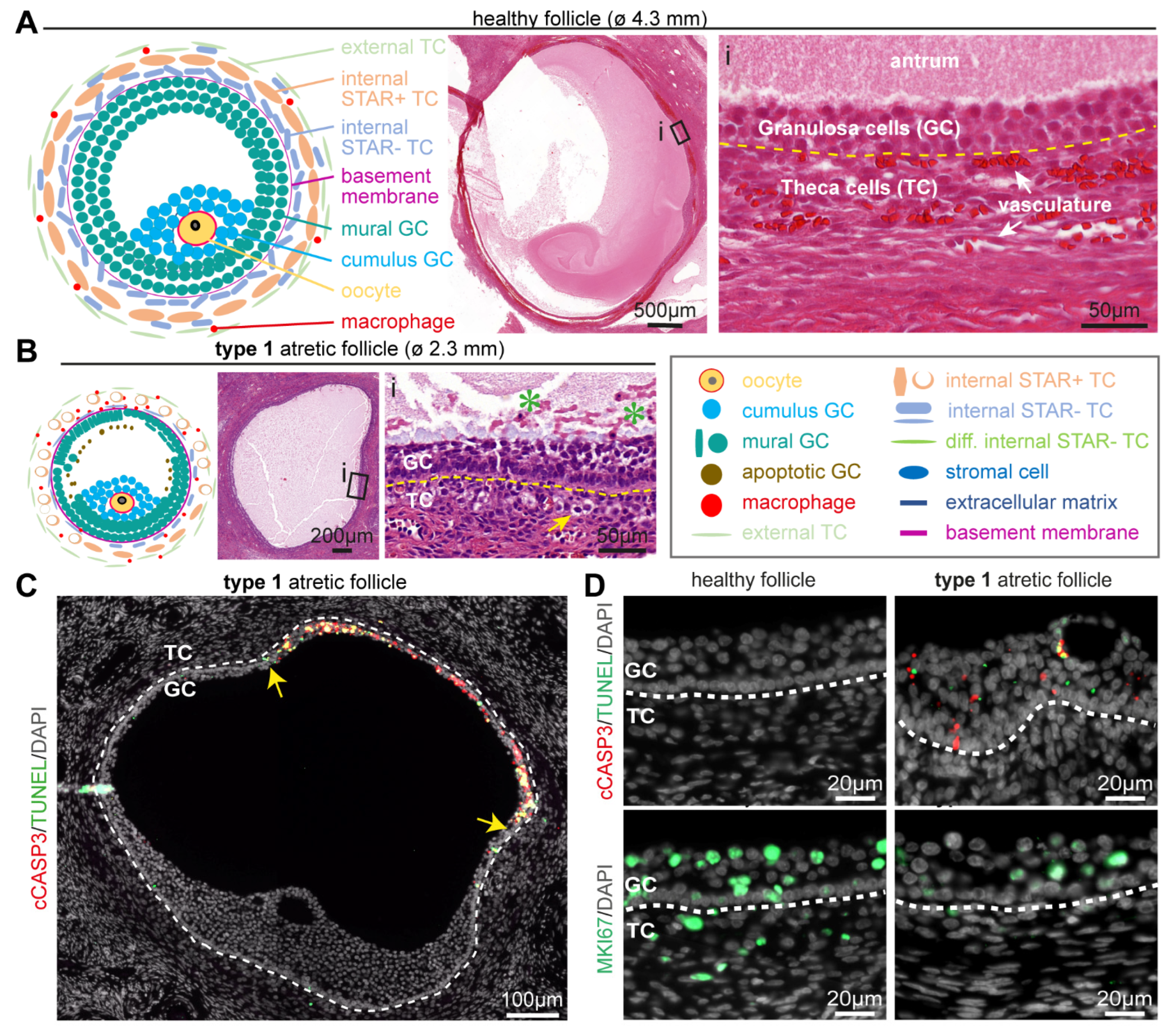 Classification of Atretic Small Antral Follicles in the Human Ovary | MDPI