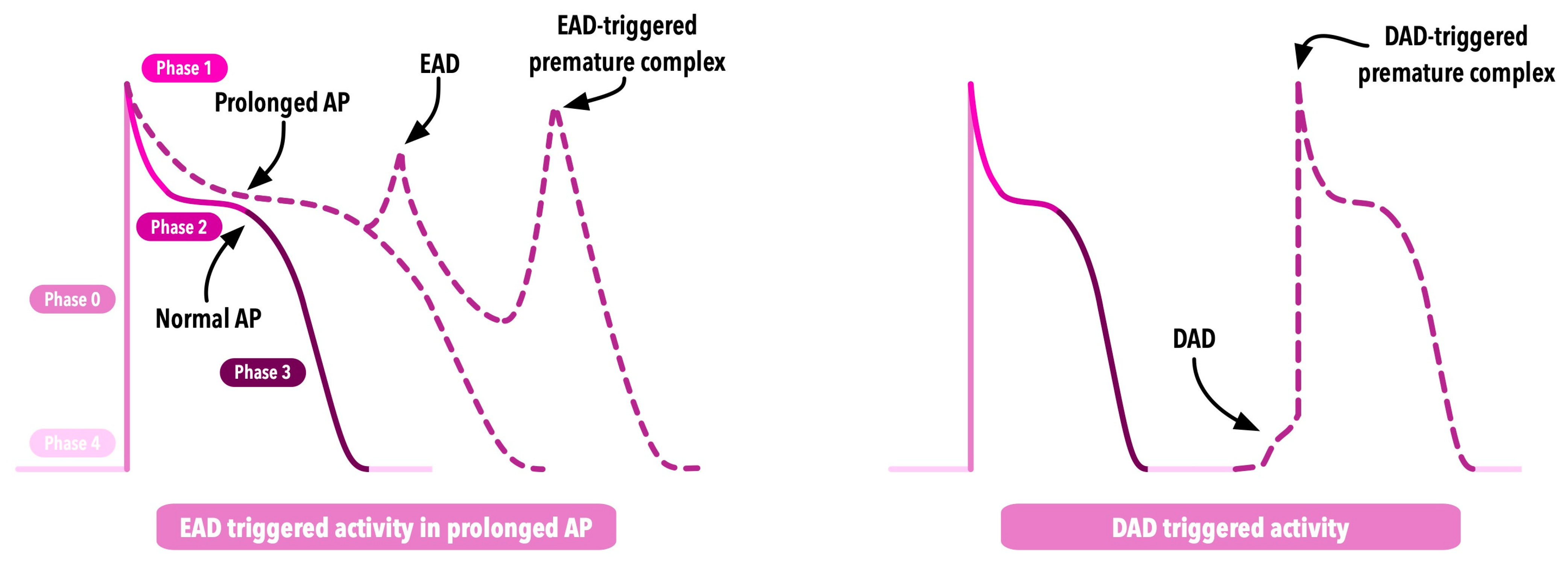 Primary Electrical Heart Disease—Principles of Pathophysiology and ...