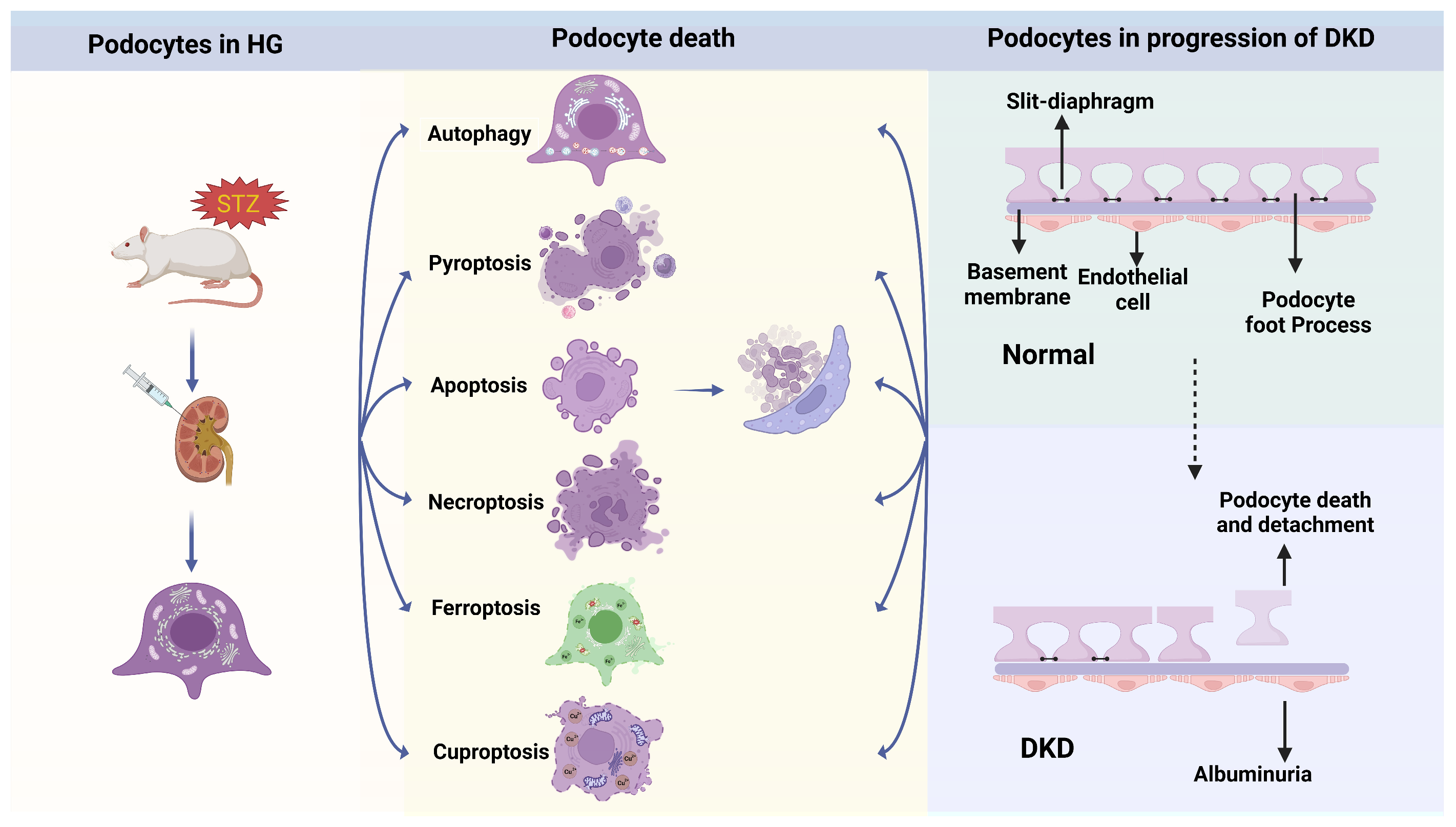 Podocyte Death in Diabetic Kidney Disease: Potential Molecular ...