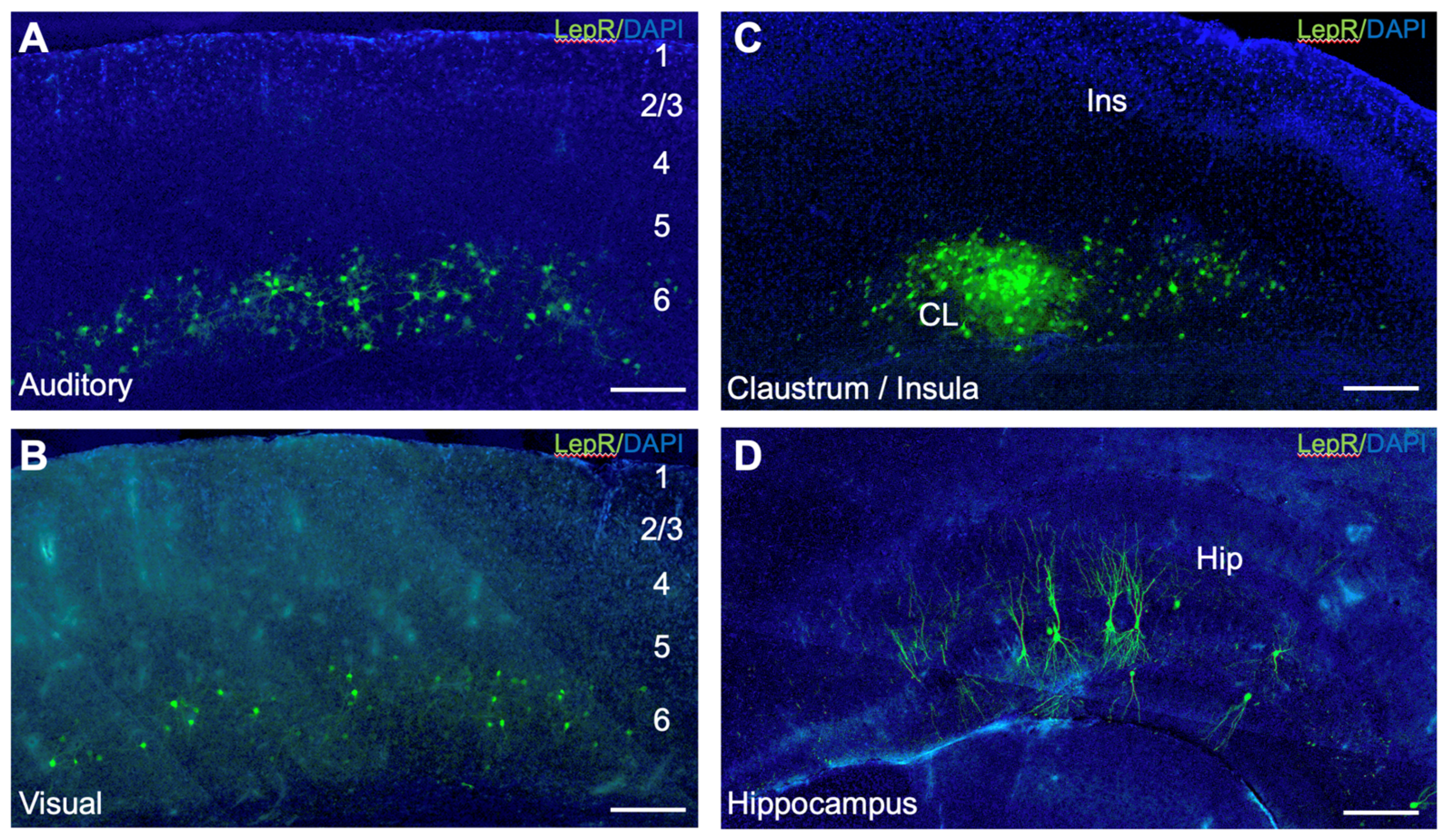Cell-Type-Specific Expression of Leptin Receptors in the Mouse ...